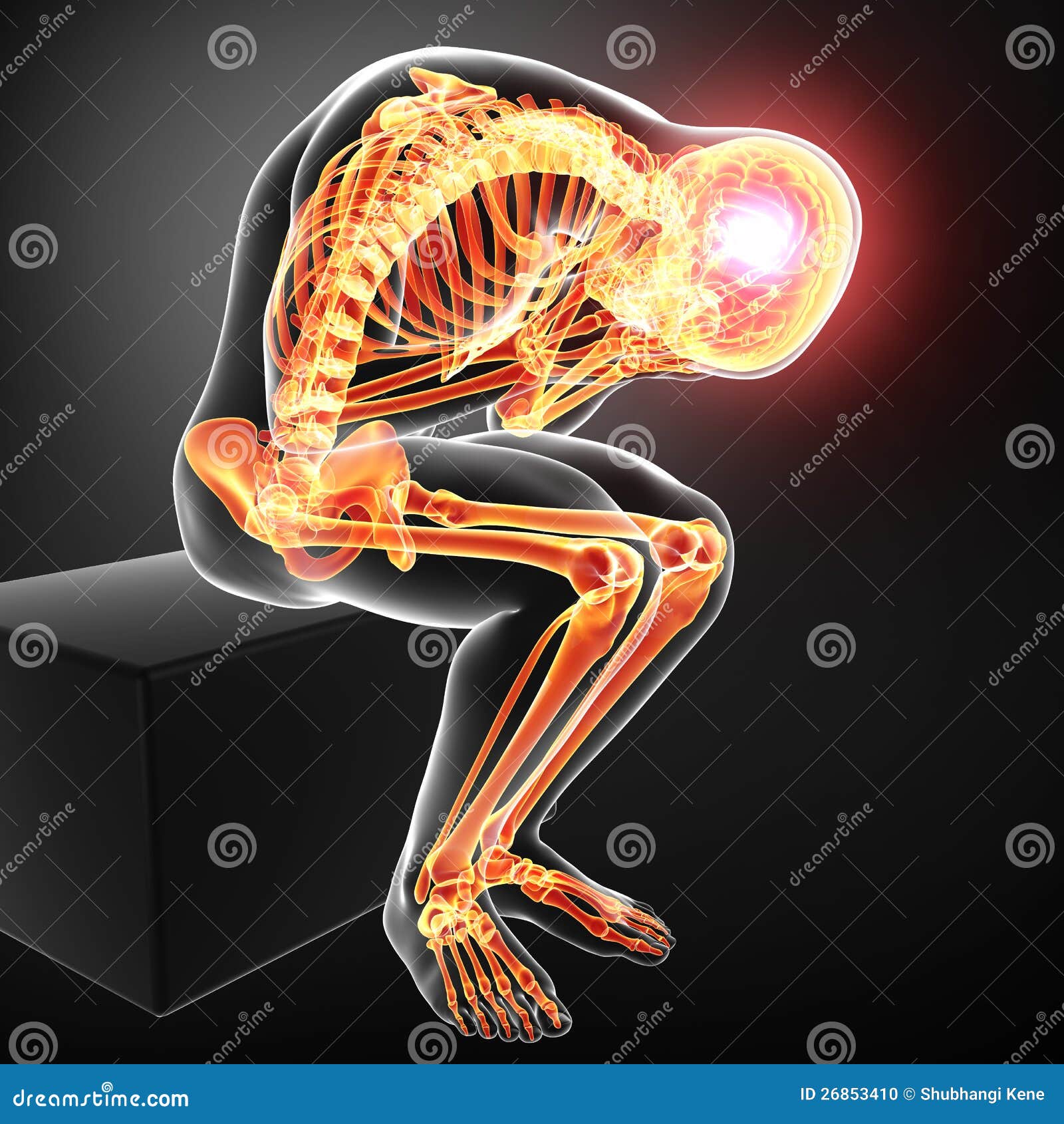 Highlighted Male Body Skeleton with Migraine Stock Illustration ...