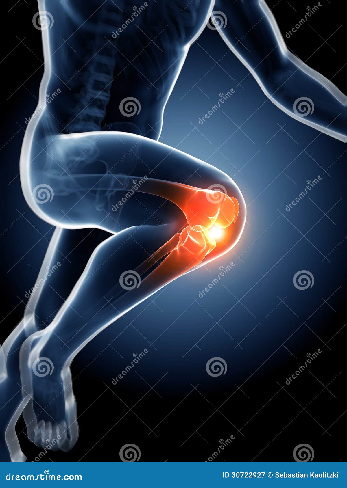 Highlighted runner joint stock illustration. Illustration of trauma ...
