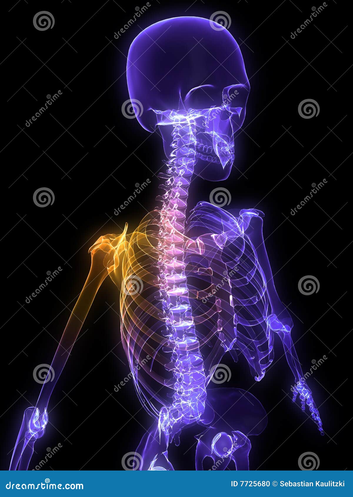 Highlighted shoulder stock illustration. Illustration of rheumatism ...