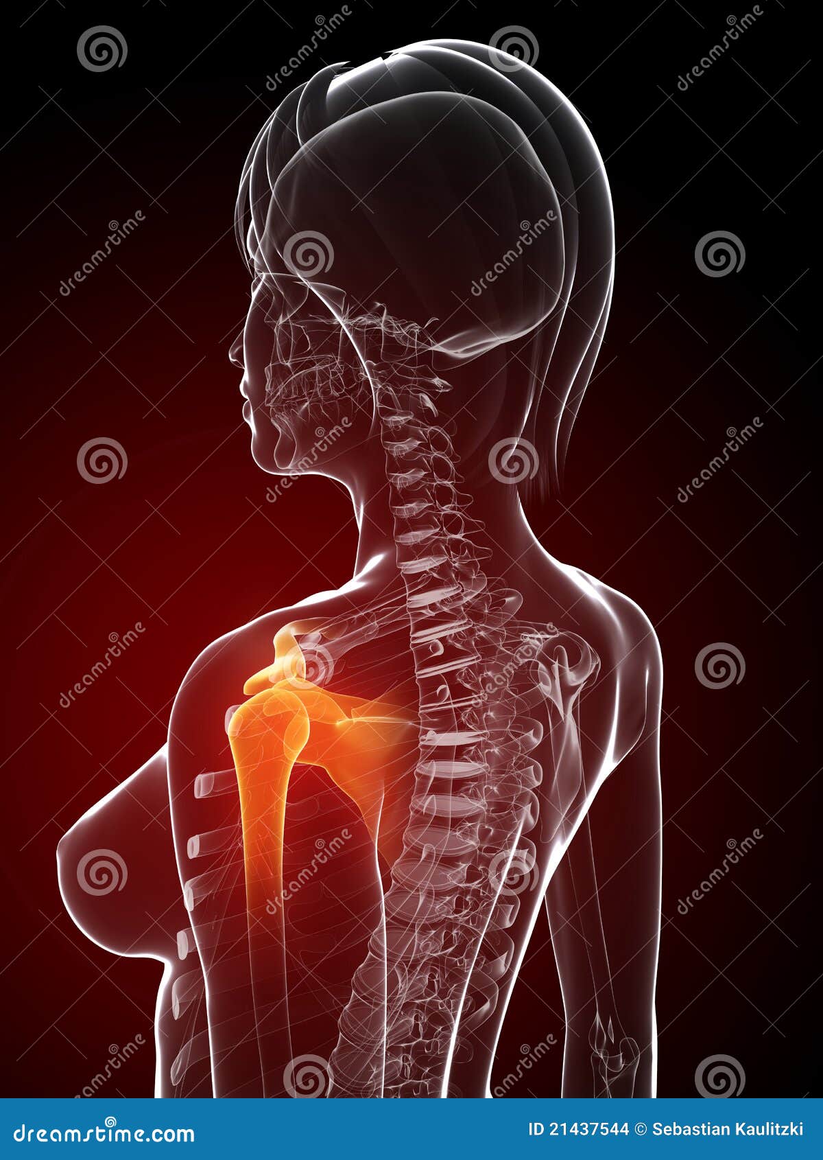 Highlighted shoulder joint stock illustration. Illustration of person ...