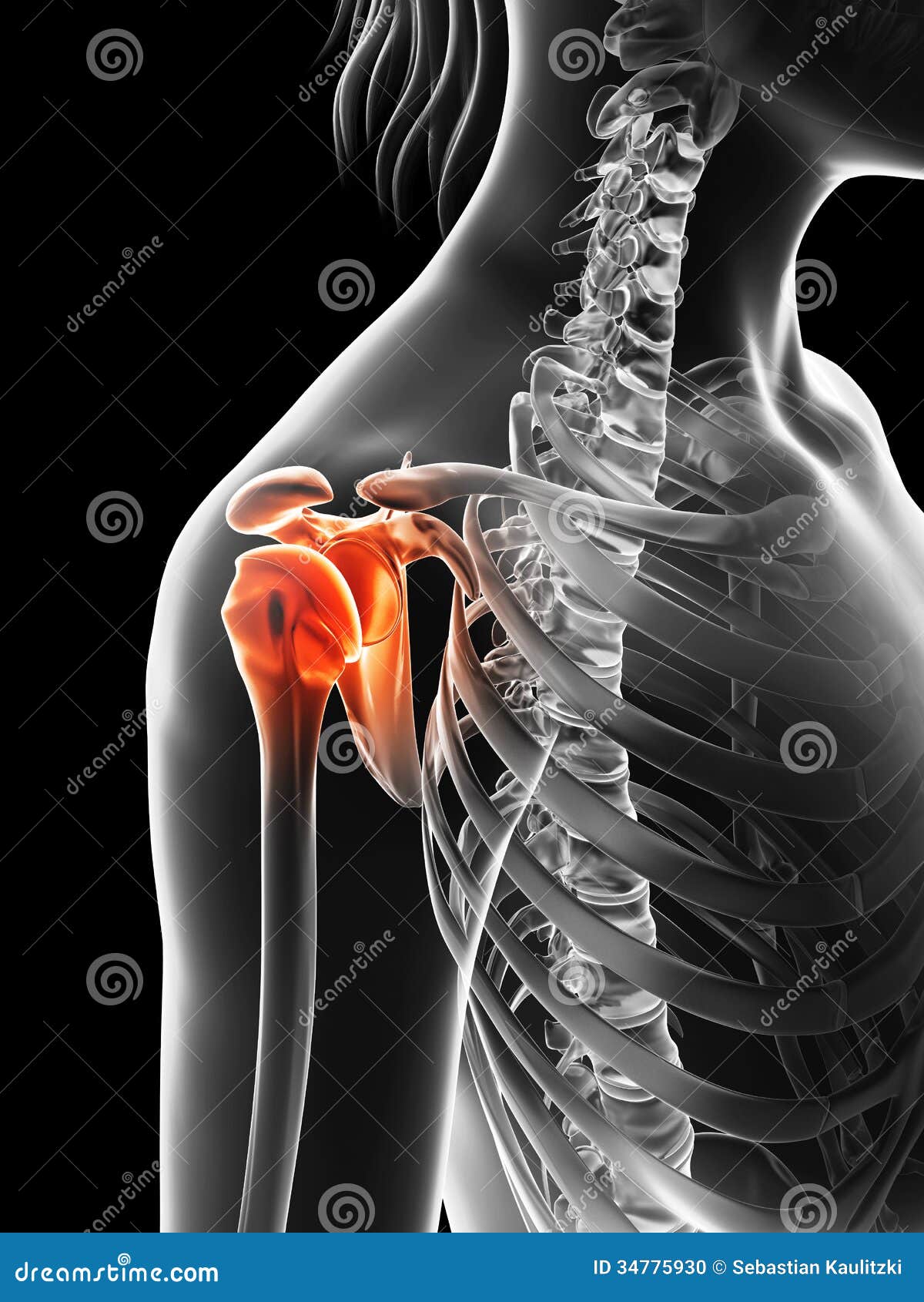 Normal Shoulder And Impingement. Illustration Of The Normal Shoulder ...