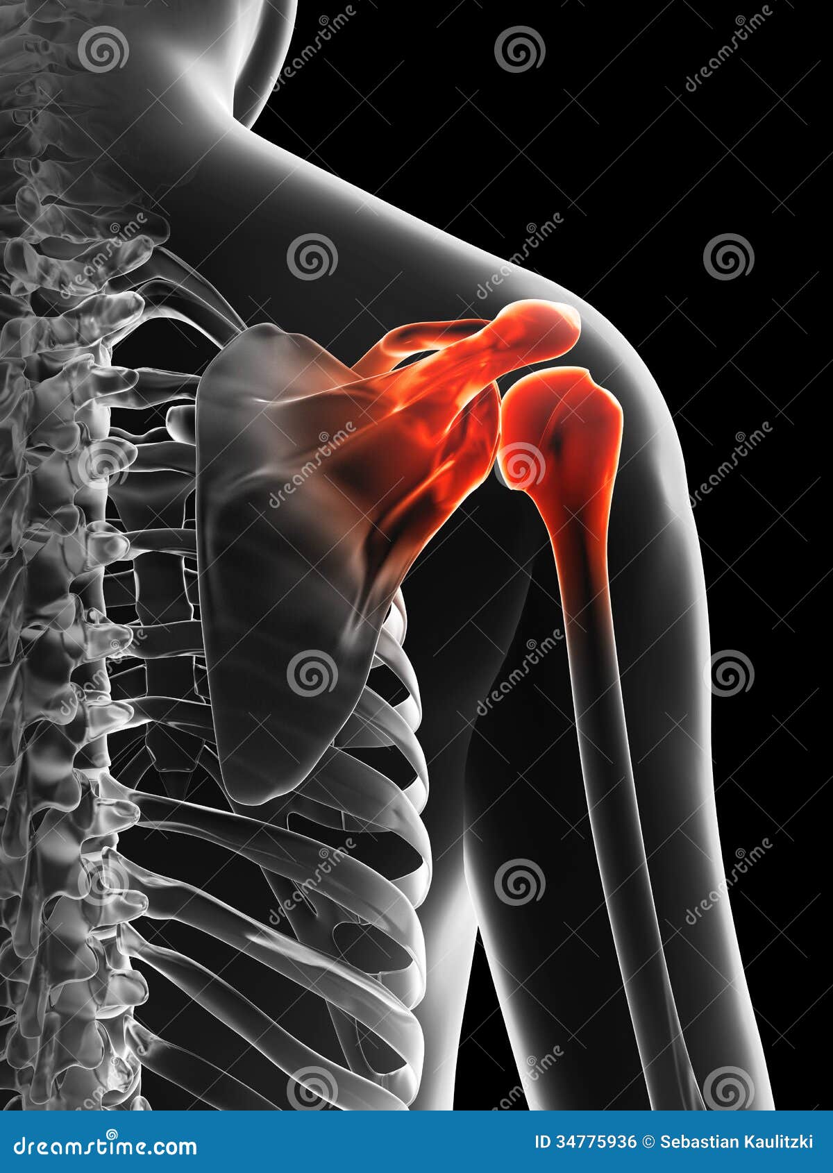 Normal Shoulder And Impingement. Illustration Of The Normal Shoulder ...