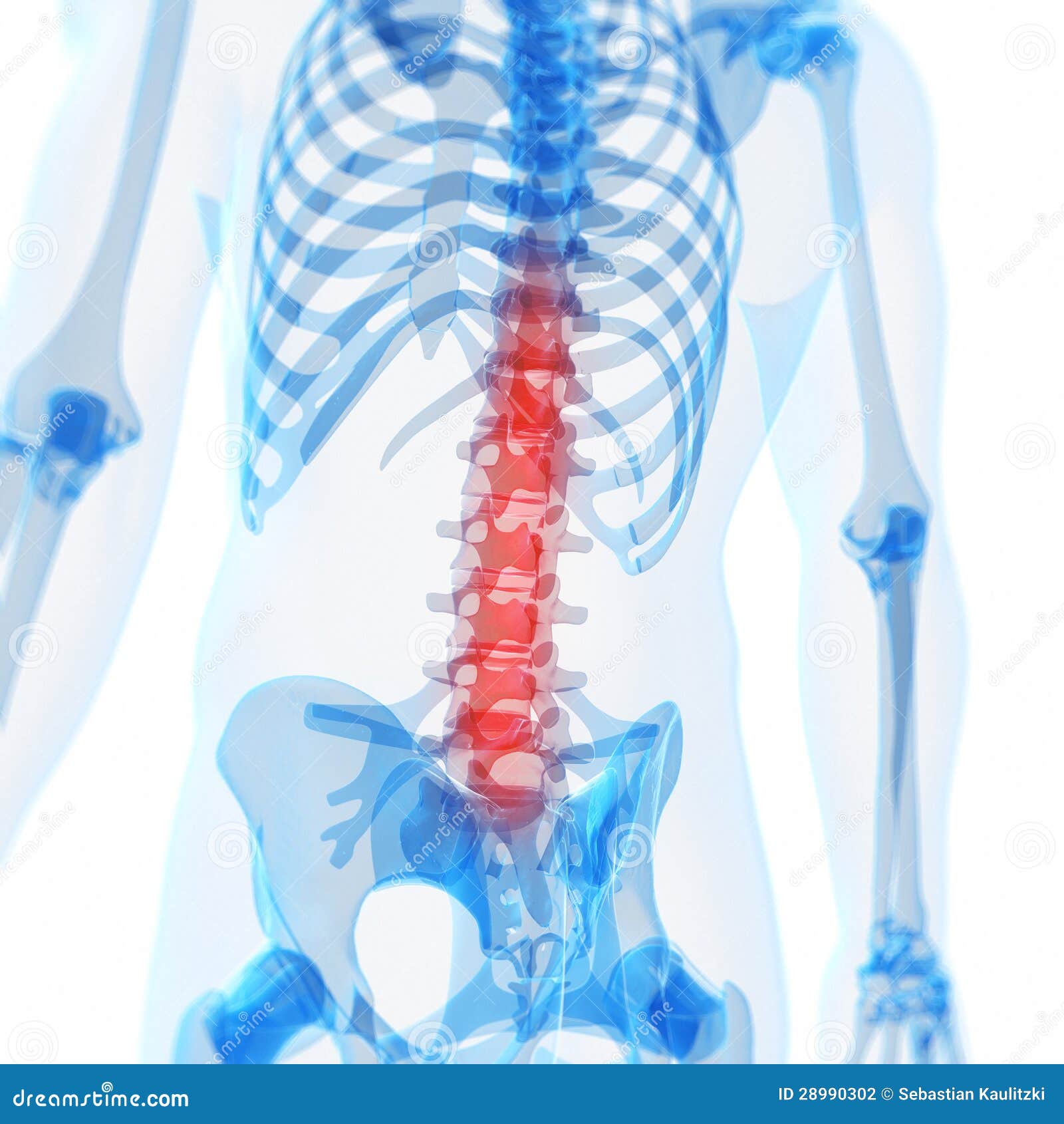 Highlighted spine stock illustration. Illustration of injury - 28990302