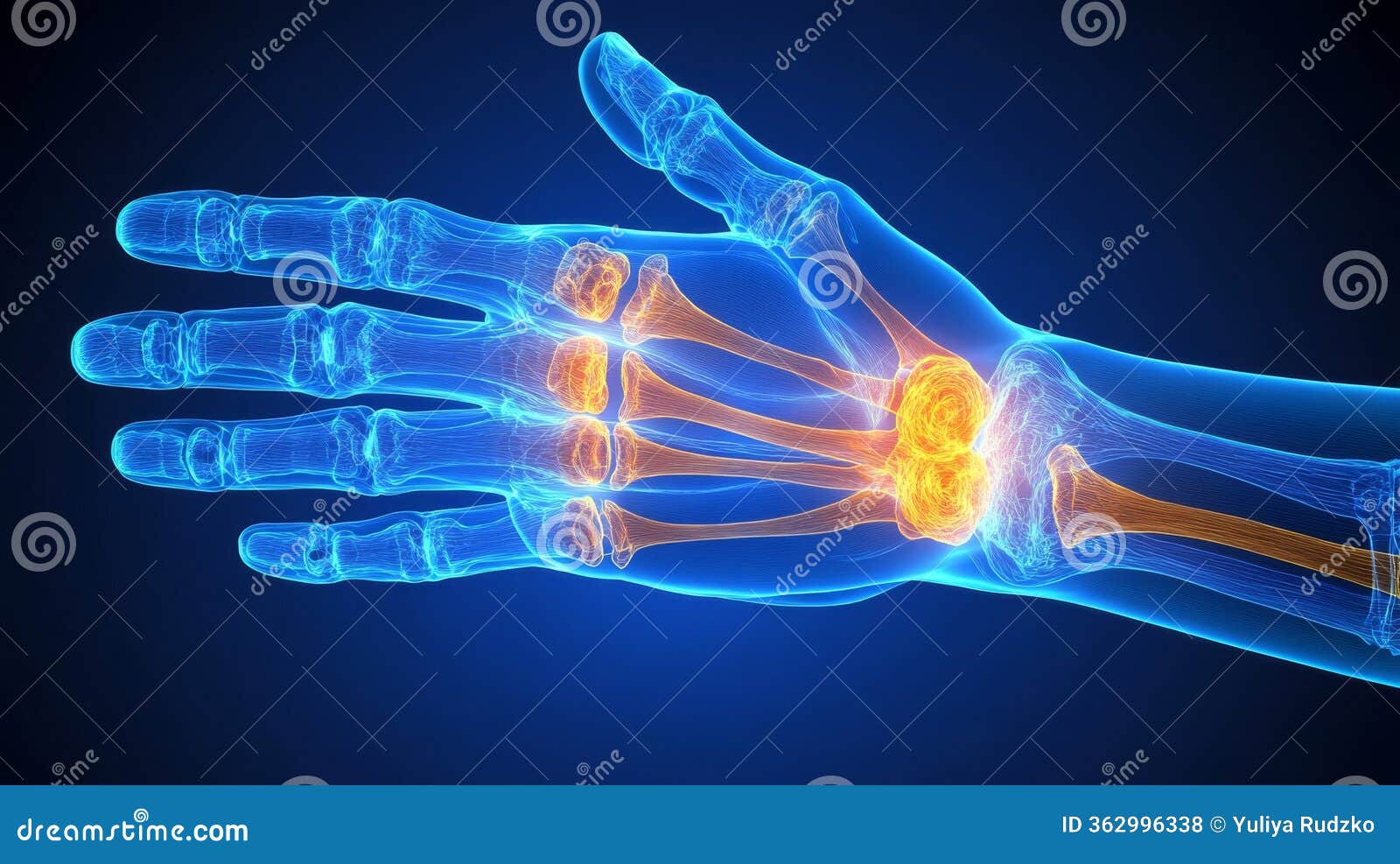 Hand In Skeleton Glove Is Violently Grabbing Flower With Bee Royalty ...