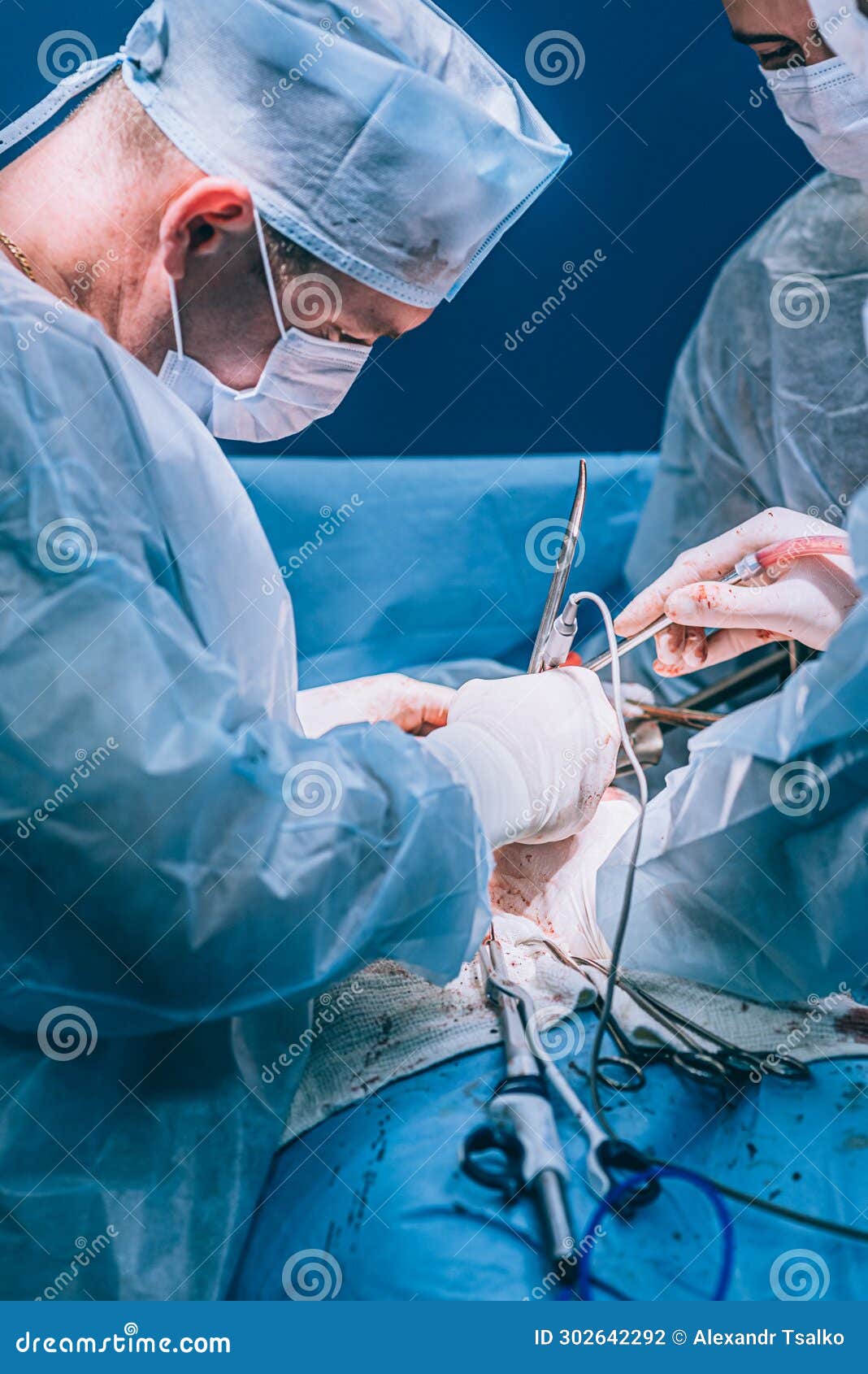 A Highly Qualified Team of Surgeons Performs a Complex Operation To ...