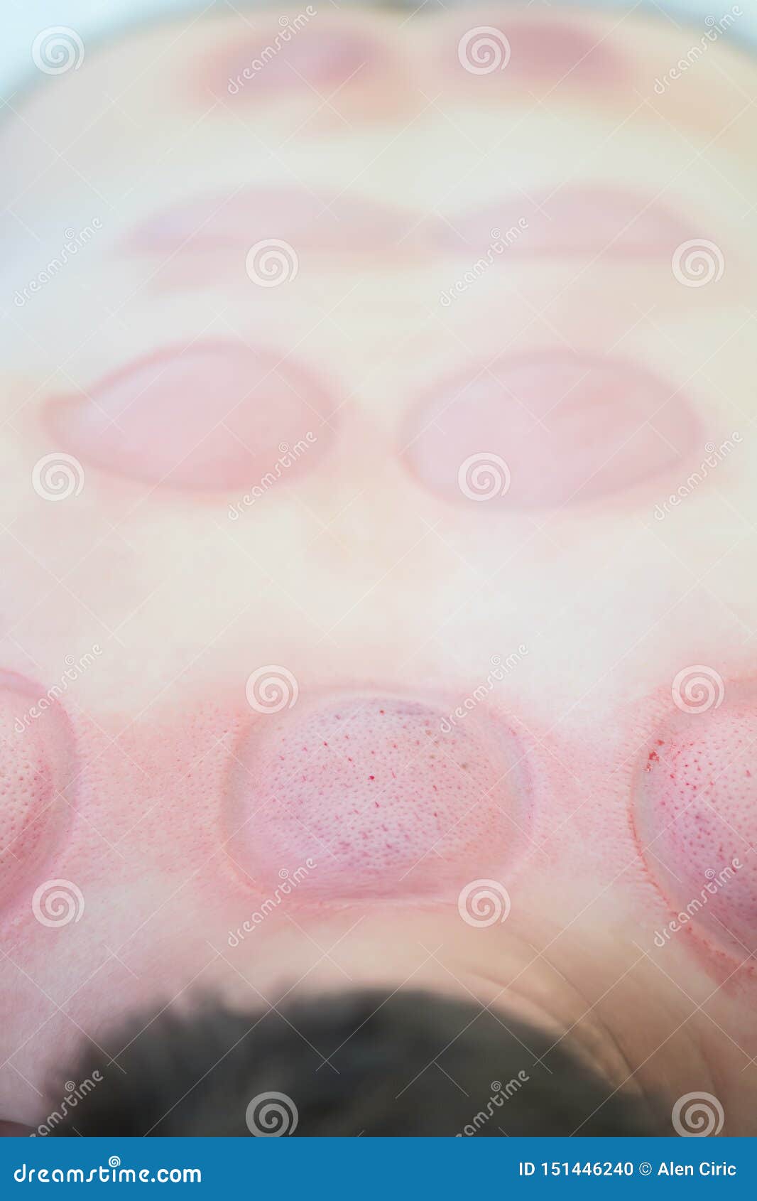 Bleeding Scars Photos - Free & Royalty-Free Stock Photos from Dreamstime