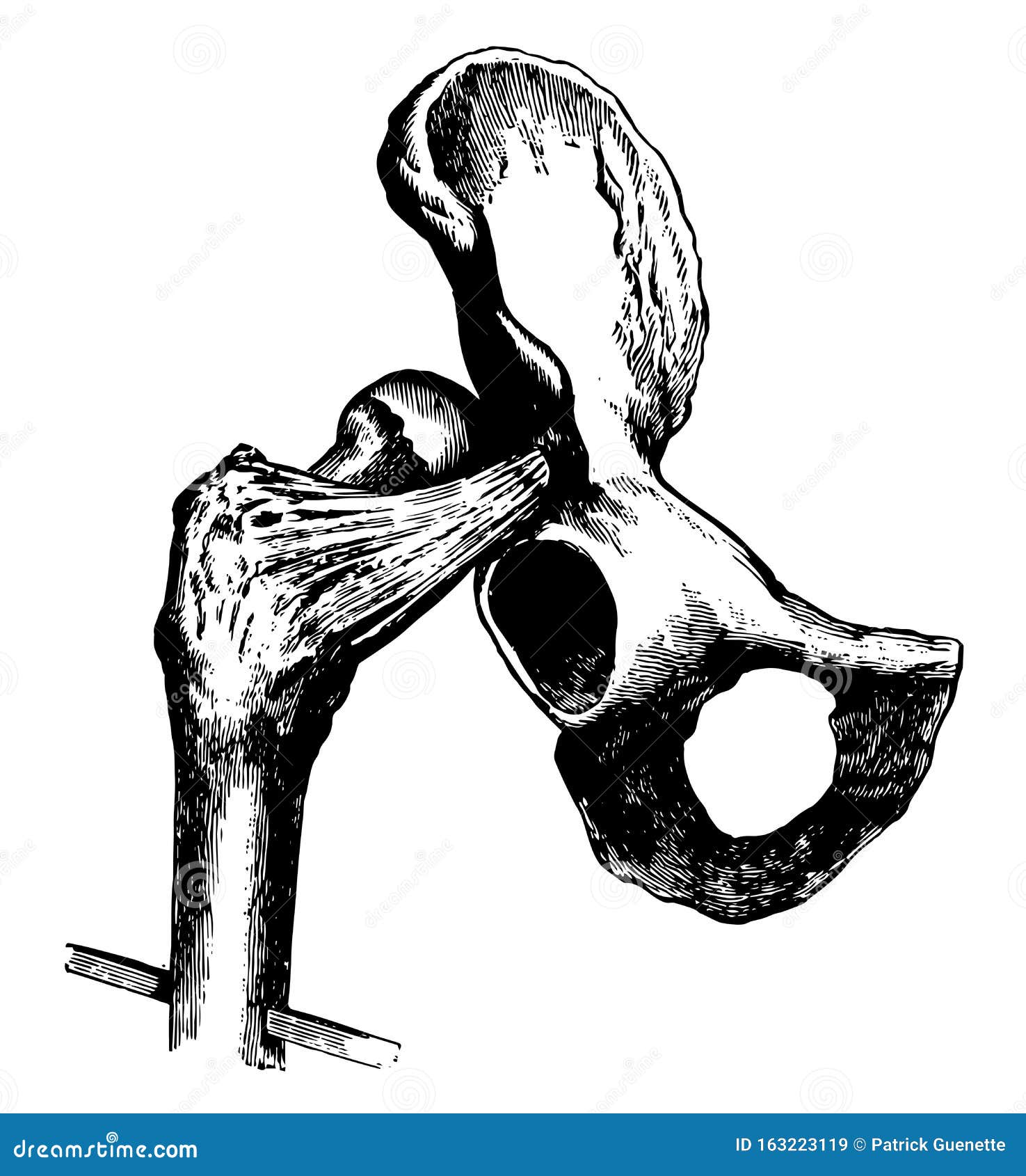 Hip Dislocation Illustration Cartoon Vector | CartoonDealer.com #258914749