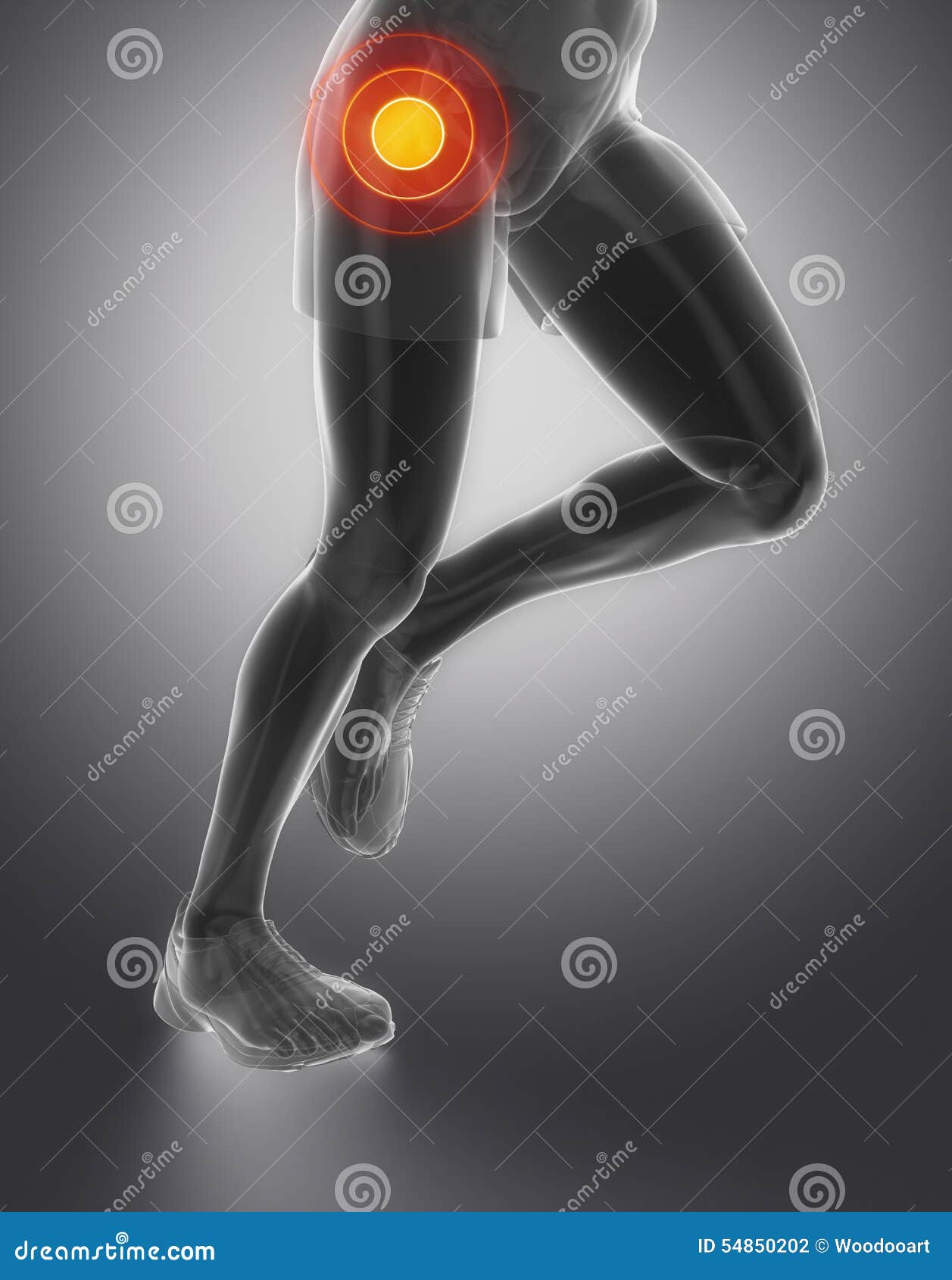 Hip pain stock illustration. Illustration of bones, joint - 54850202