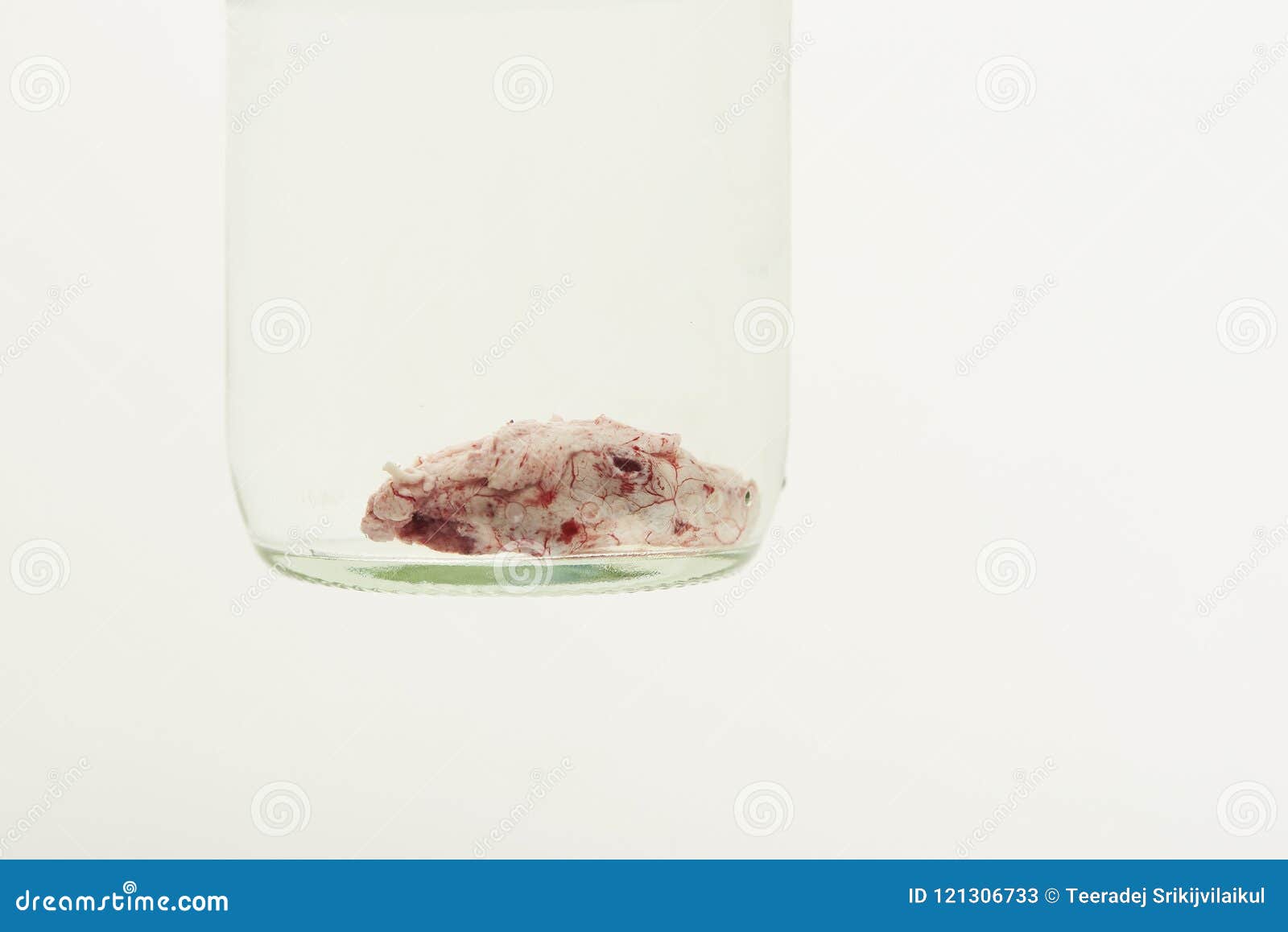 Part of Brain Specimen in Plastic Container Stock Image - Image of ...