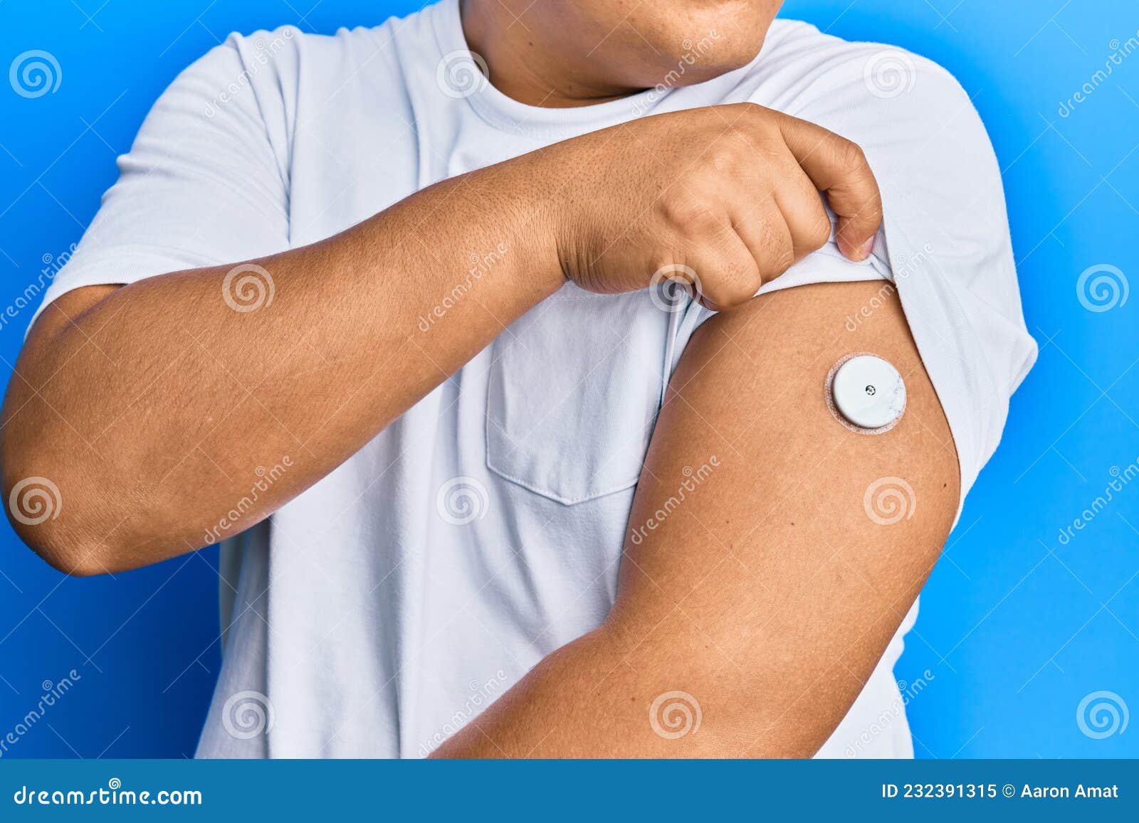 Hispanic Man Showing Diabetes Device on Arm Stock Image - Image of ...