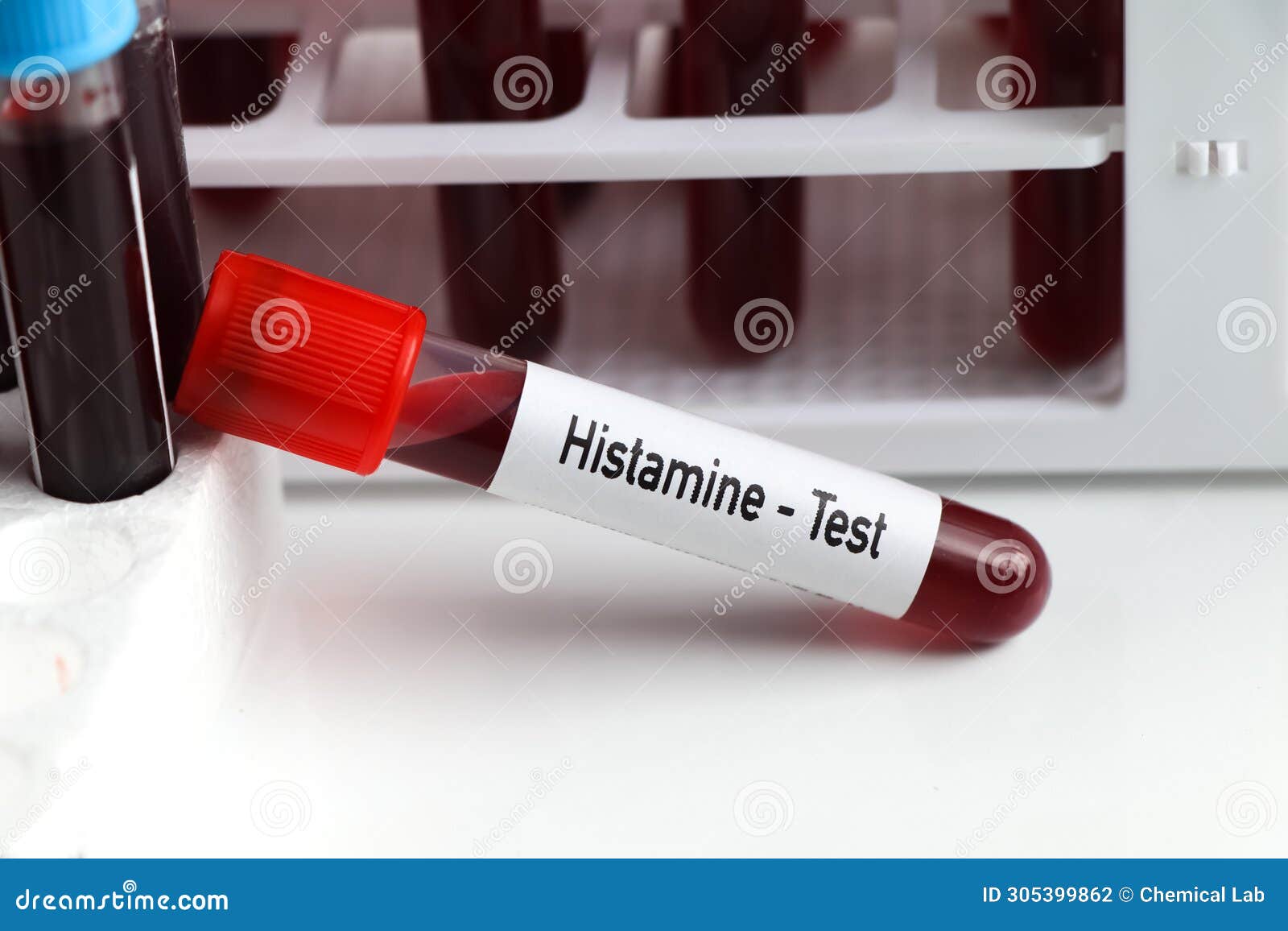 Histamine Test, Blood Sample To Analyze in the Laboratory Stock Photo ...