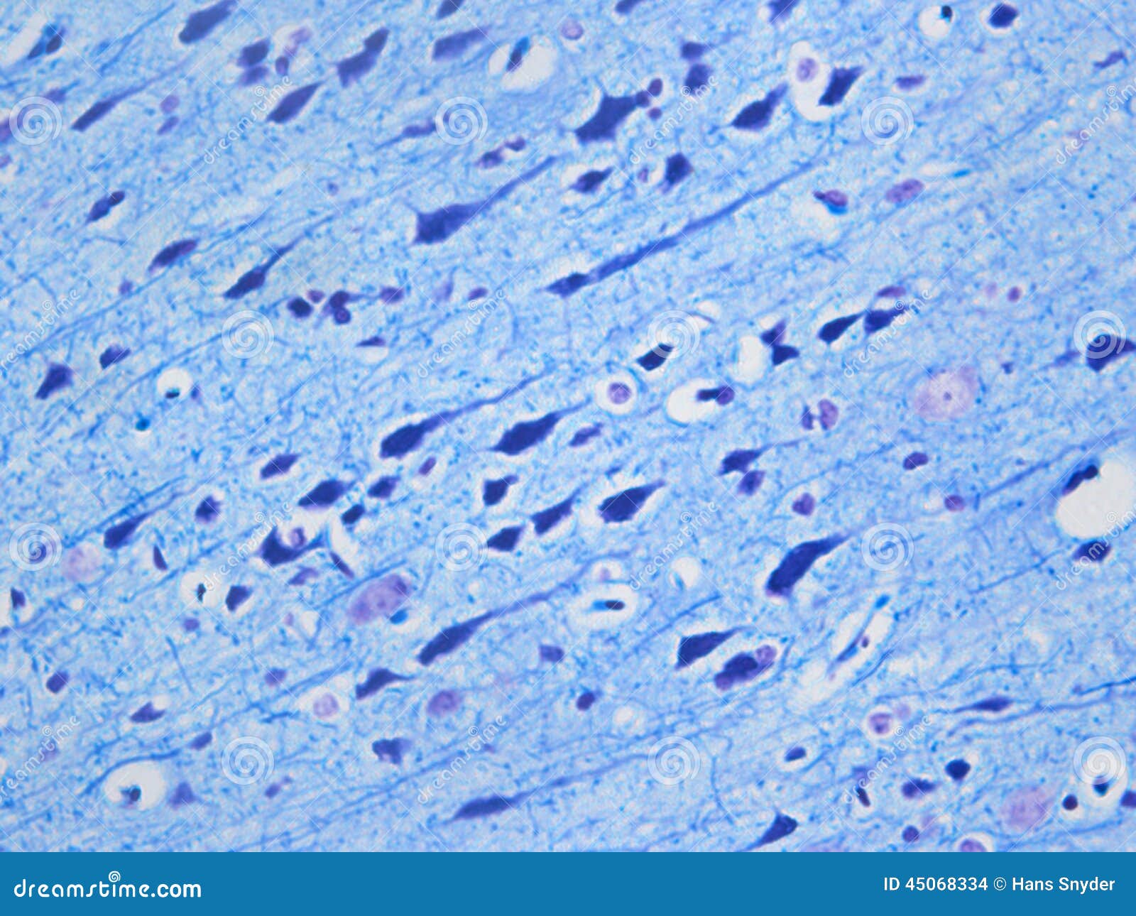 Histología Del Cerebro Normal Usando LFB/CV Foto de archivo - Imagen de ...