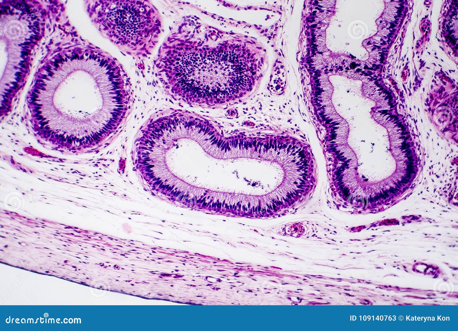 Histología Del Tejido Humano Del Epidídimo Imagen de archivo - Imagen ...