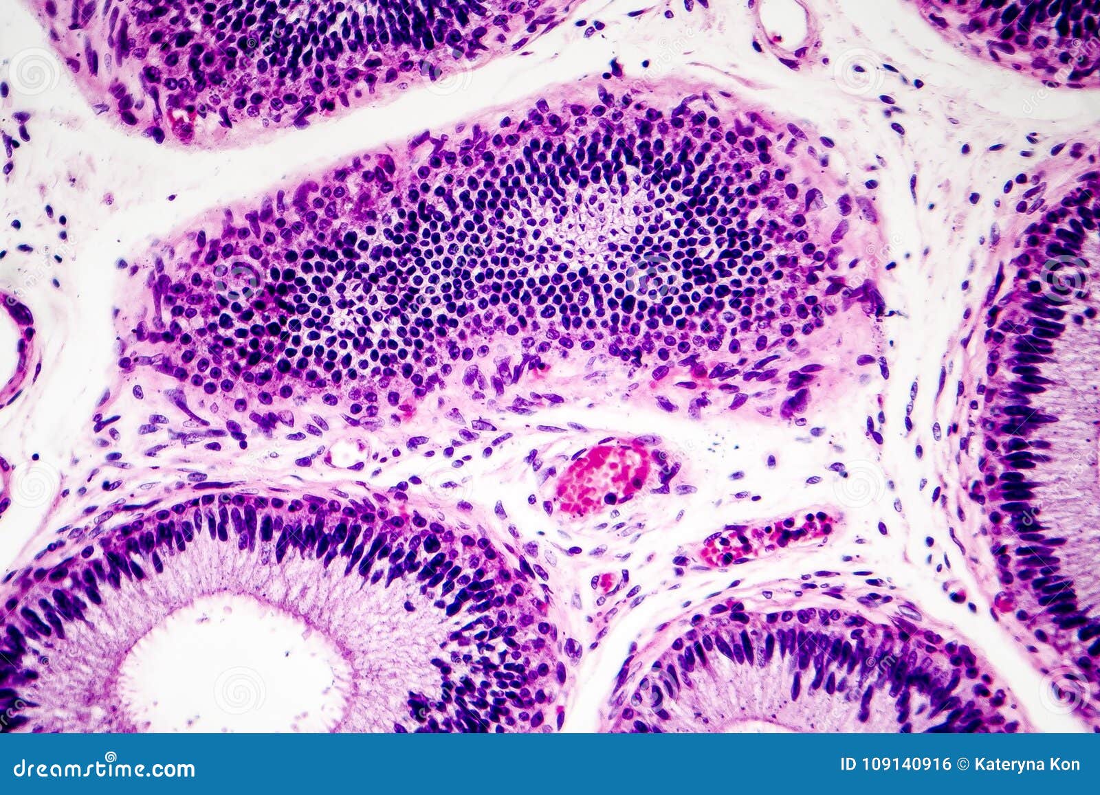 Histología Del Tejido Humano Del Epidídimo Foto de archivo - Imagen de ...
