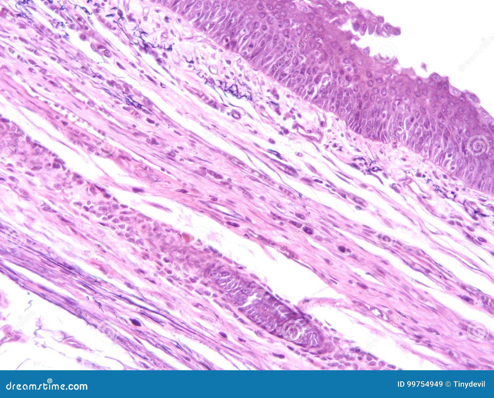 Histologia Cartilage Istoty Ludzkiej Tkanka Obraz Stock Obraz