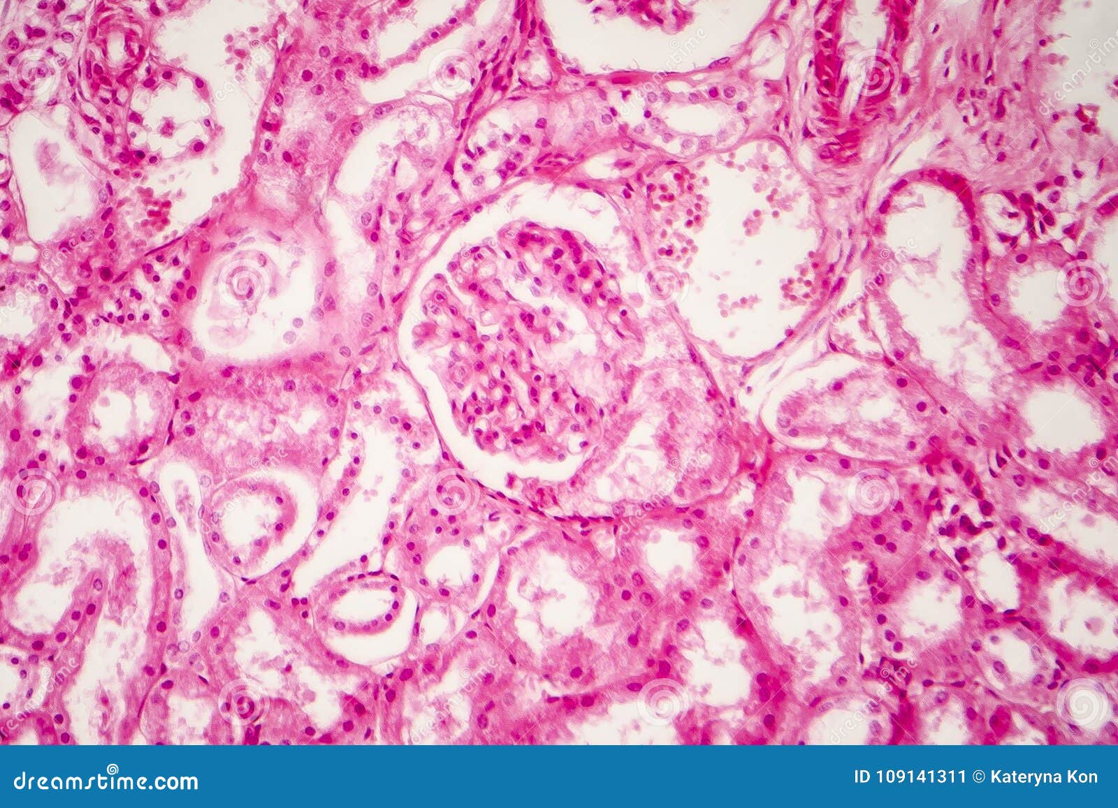 Histologia do rim humano imagem de stock. Imagem de fotomicrografo ...