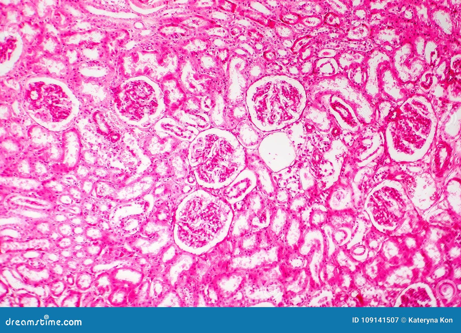 Histologia do rim humano imagem de stock. Imagem de ciência - 109141507