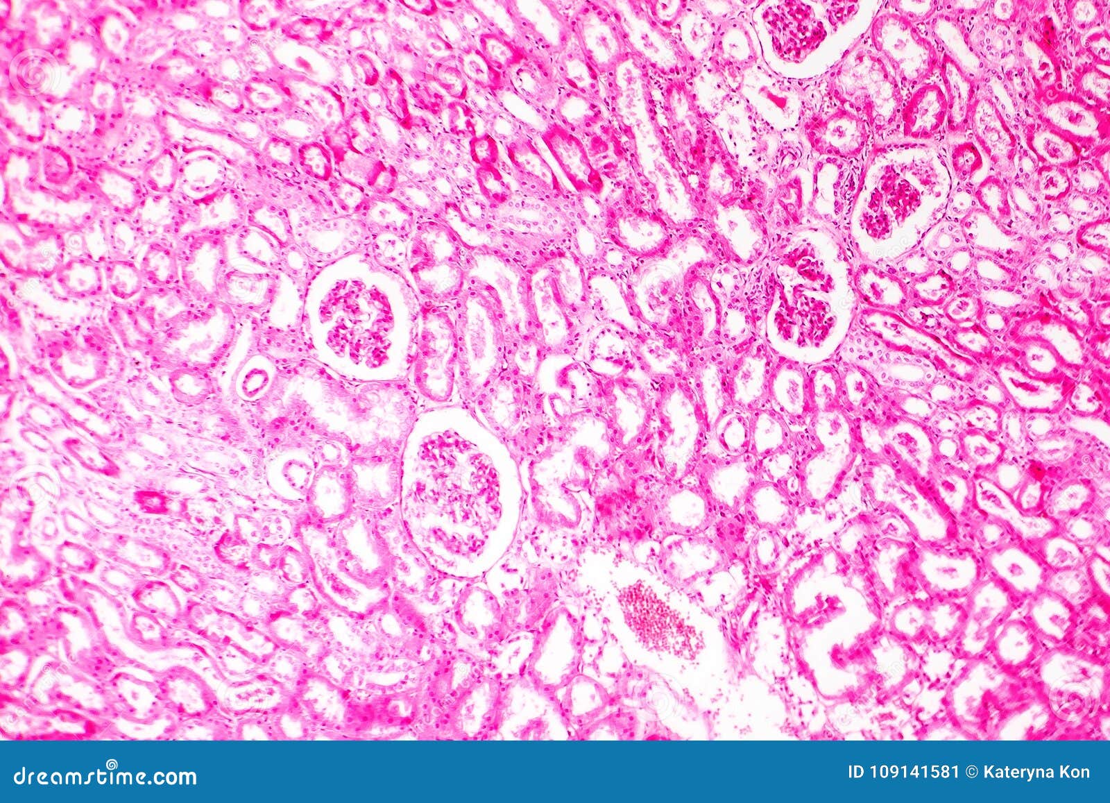 Histologia do rim humano imagem de stock. Imagem de tecido - 109141581