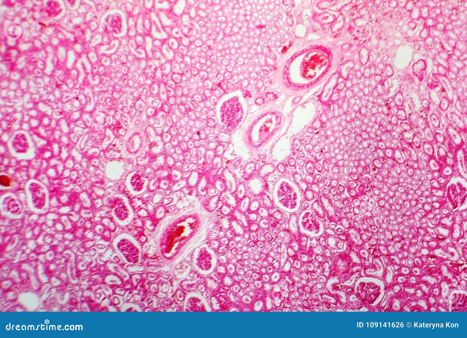 Histologia do rim humano foto de stock. Imagem de sistema - 109141626