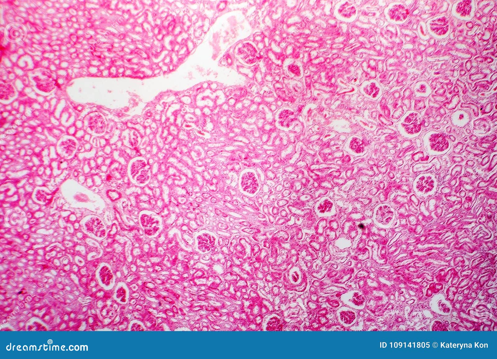 Histologia do rim humano imagem de stock. Imagem de médico - 109141805