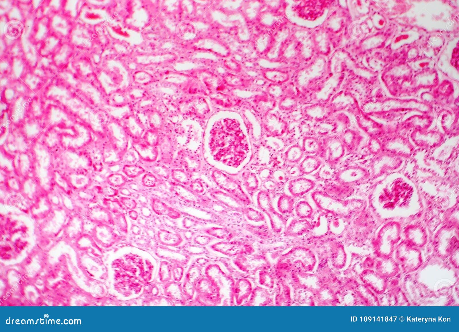 Histologia do rim humano imagem de stock. Imagem de pilhas - 109141847