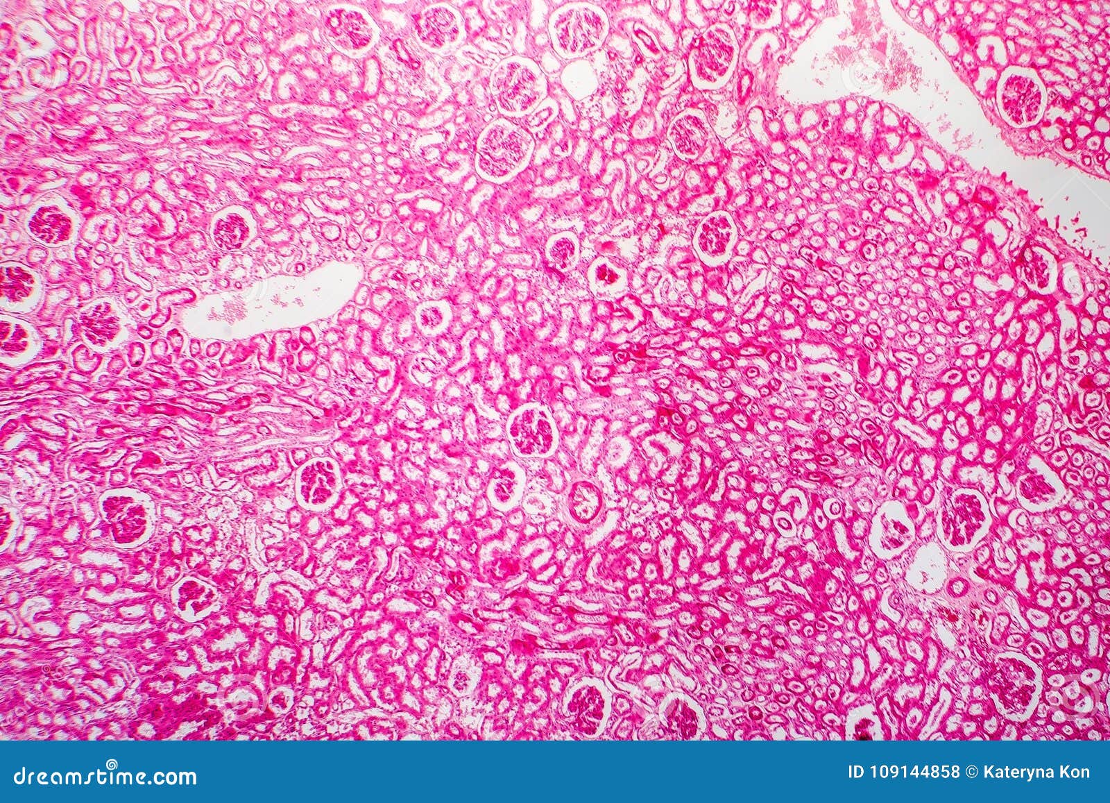 Histologia do rim humano foto de stock. Imagem de medicina - 109144858