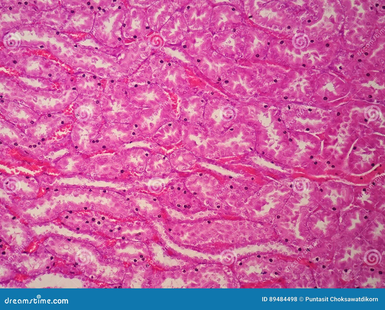 Histologia do rim humano foto de stock. Imagem de microscopia - 89484498