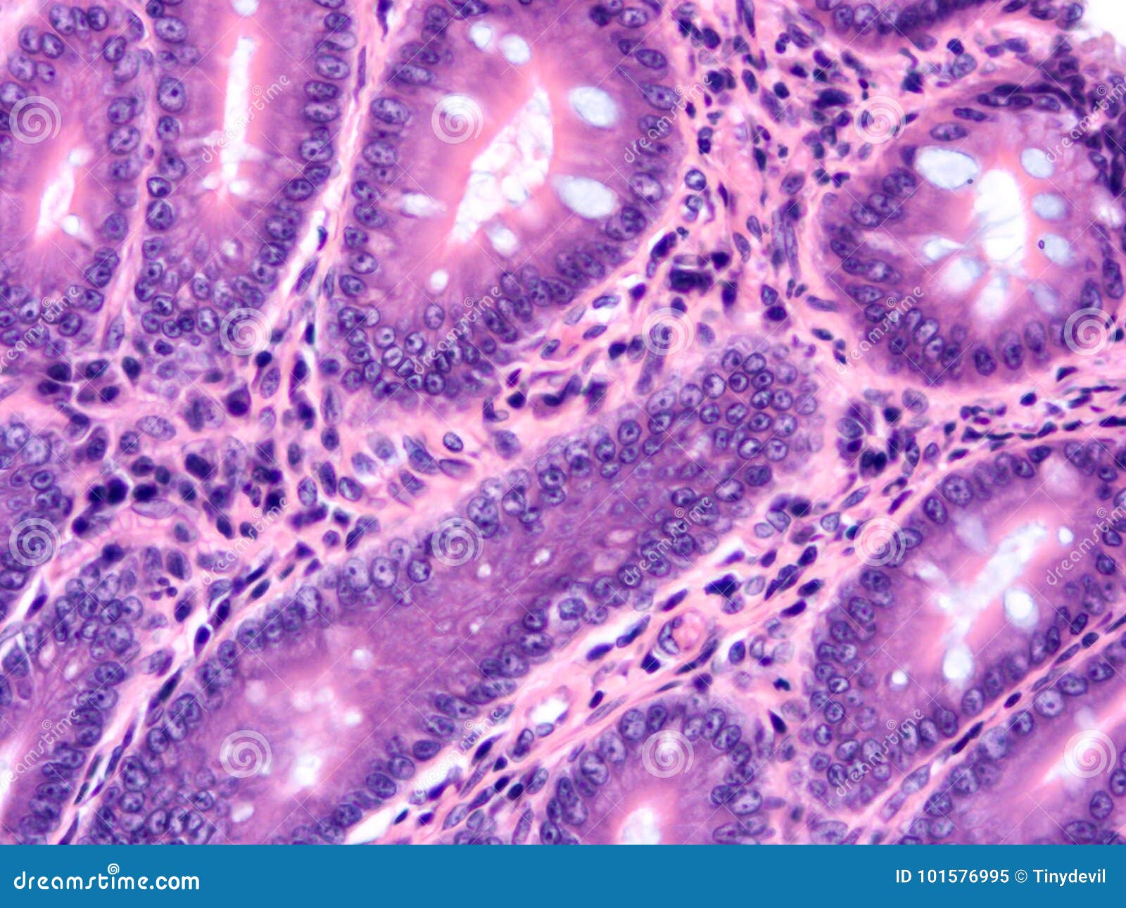 Histologia Do Tecido Humano Imagem de Stock - Imagem de histologia ...