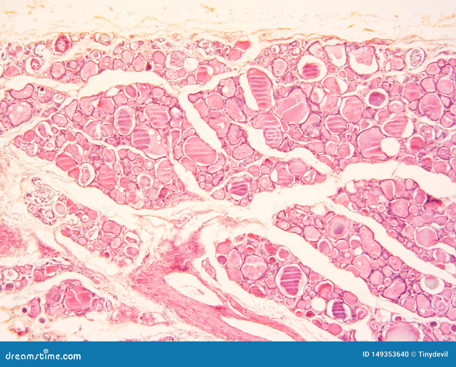 Histologia Do Tecido Humano Da Glndula De Tiroide Foto De Stock