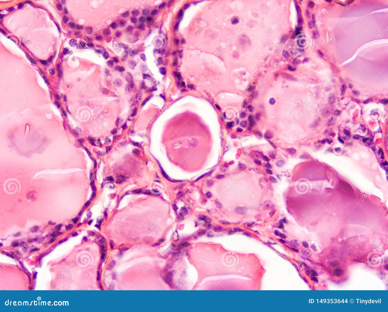 Histologia Do Tecido Humano Da Glndula De Tiroide Foto De Stock