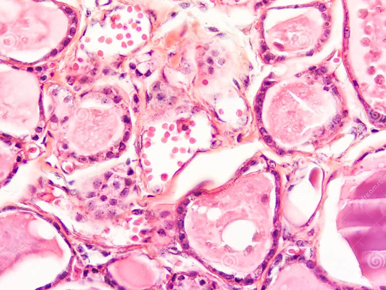 Histologia Do Tecido Humano Da Glndula De Tiroide Imagem De Stock
