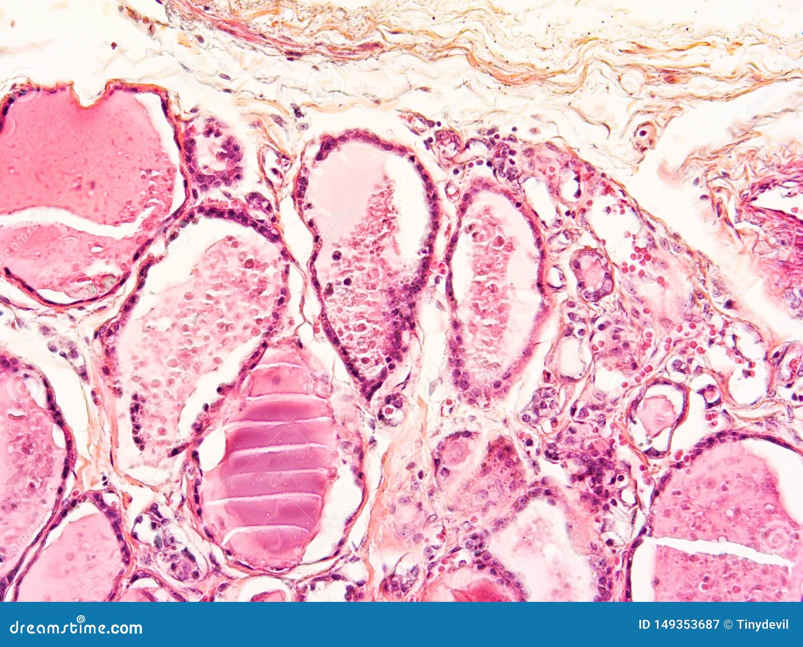 Histologia Do Tecido Humano Da Glndula De Tiroide Imagem De Stock
