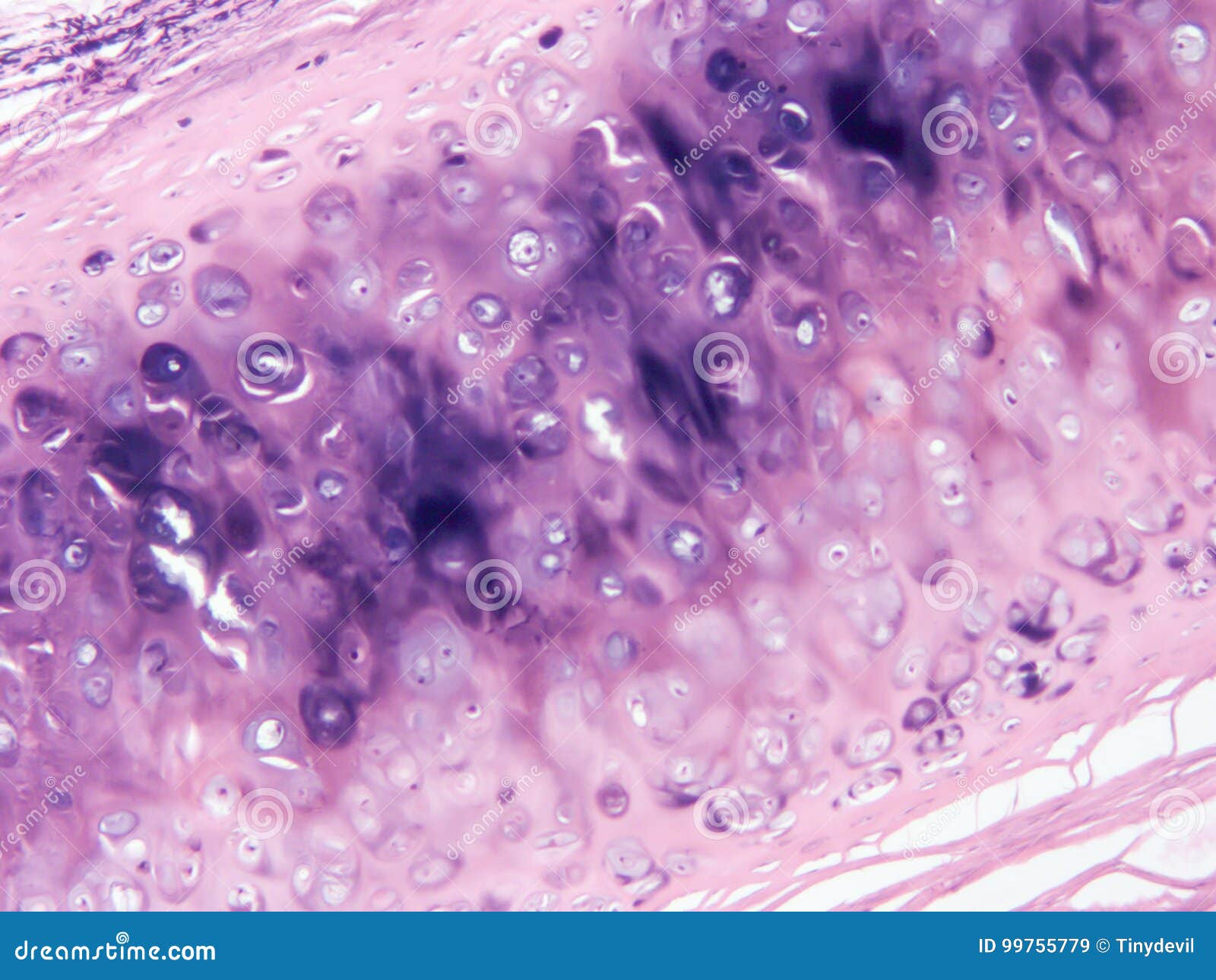 Histologia Do Tecido Do Ser Humano Da Cartilagem Imagem de Stock ...
