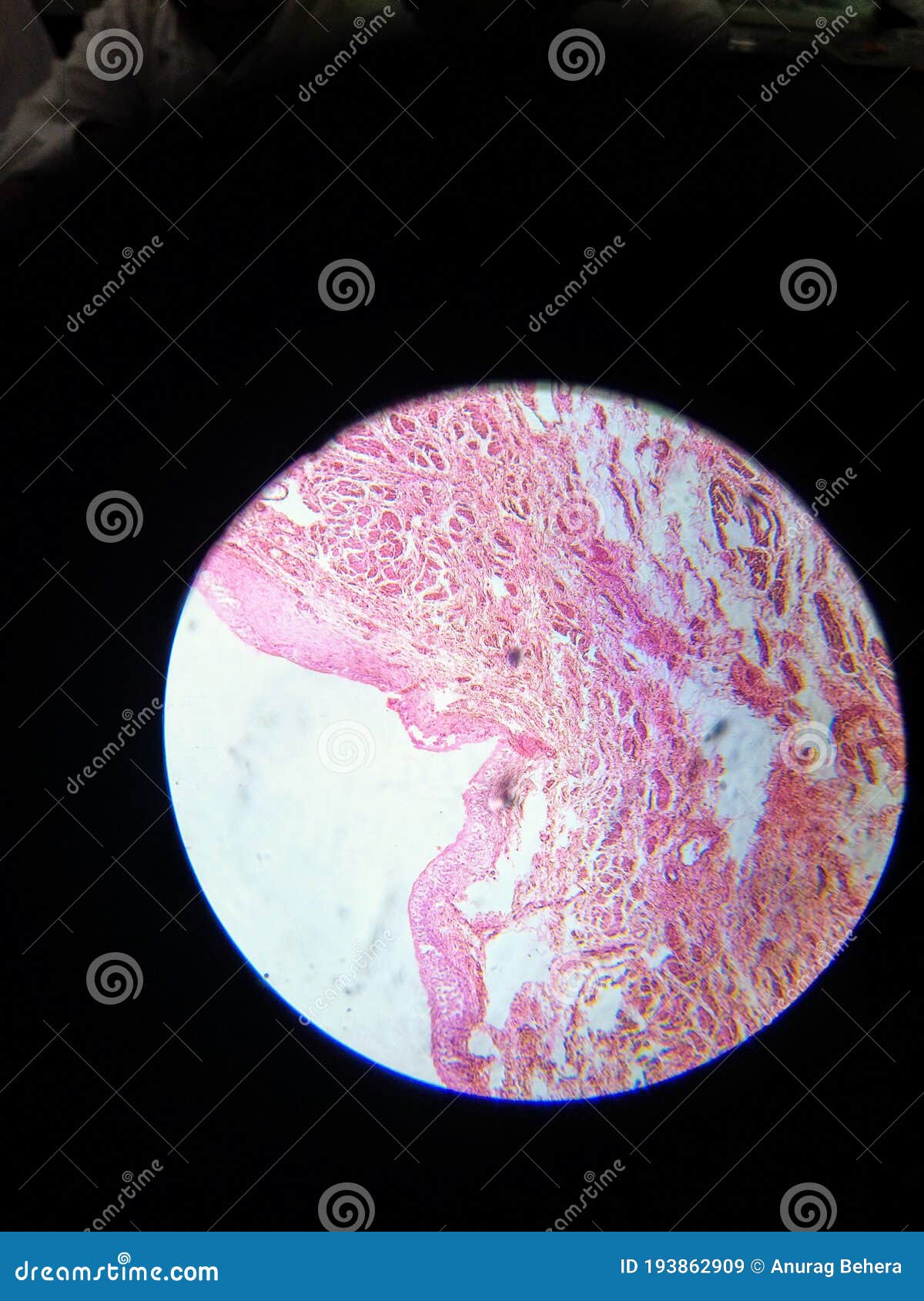 Trachea Cross Section