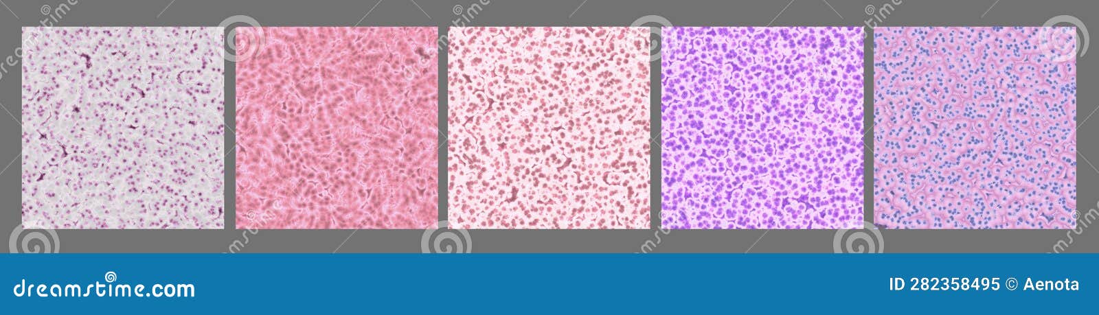 Histologic Sample Structures Set - Visualization Of Tissues Cross ...