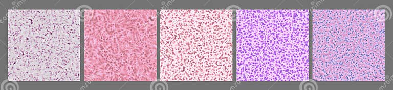 Histologic Sample Structures Set - Visualization of Tissues Cross ...