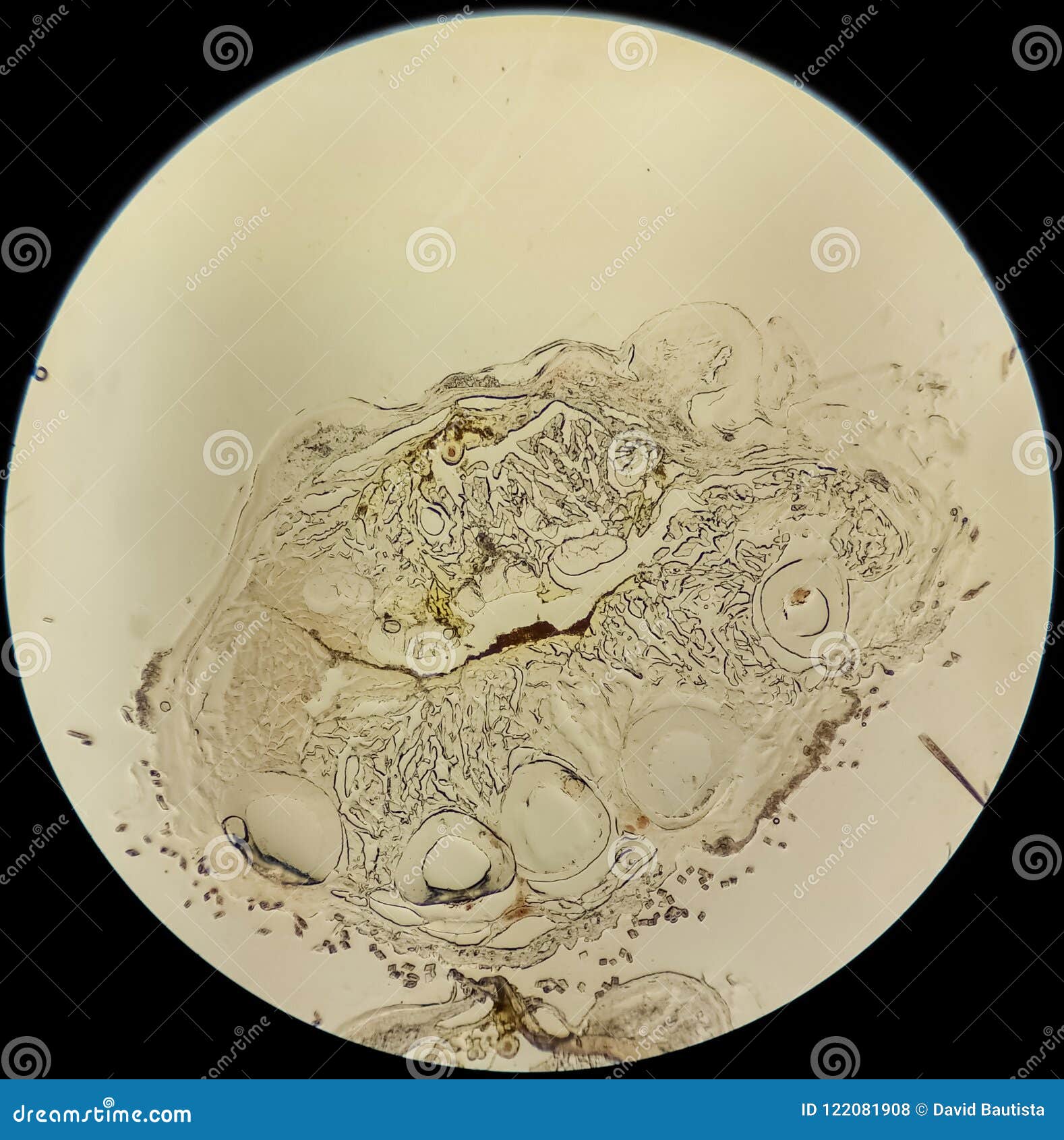 Histological Cross-section of the Tissue of a Mouse Leg Under ...