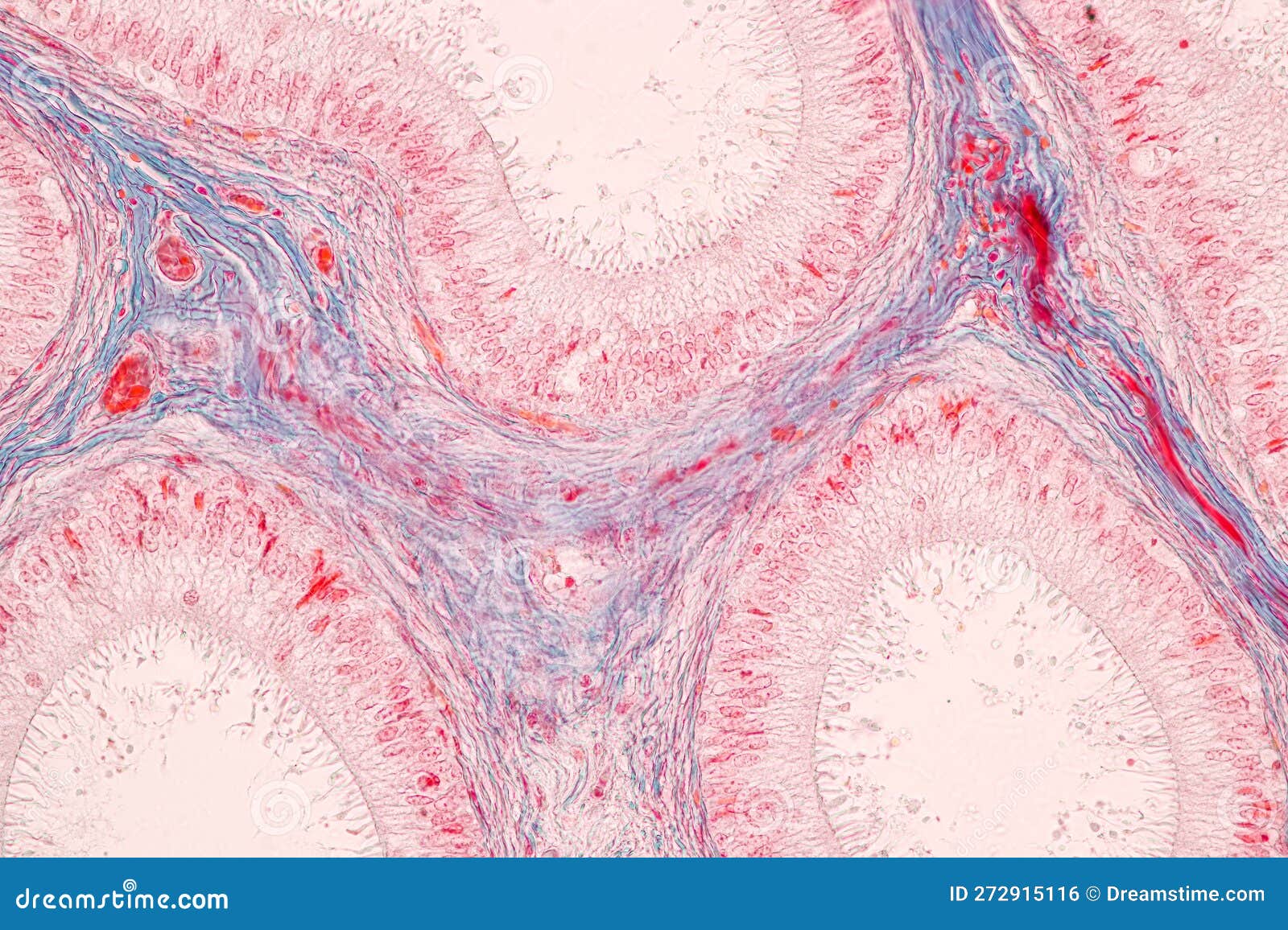Histological Epididymis and Testis Human Cells Under Microscope. Stock ...