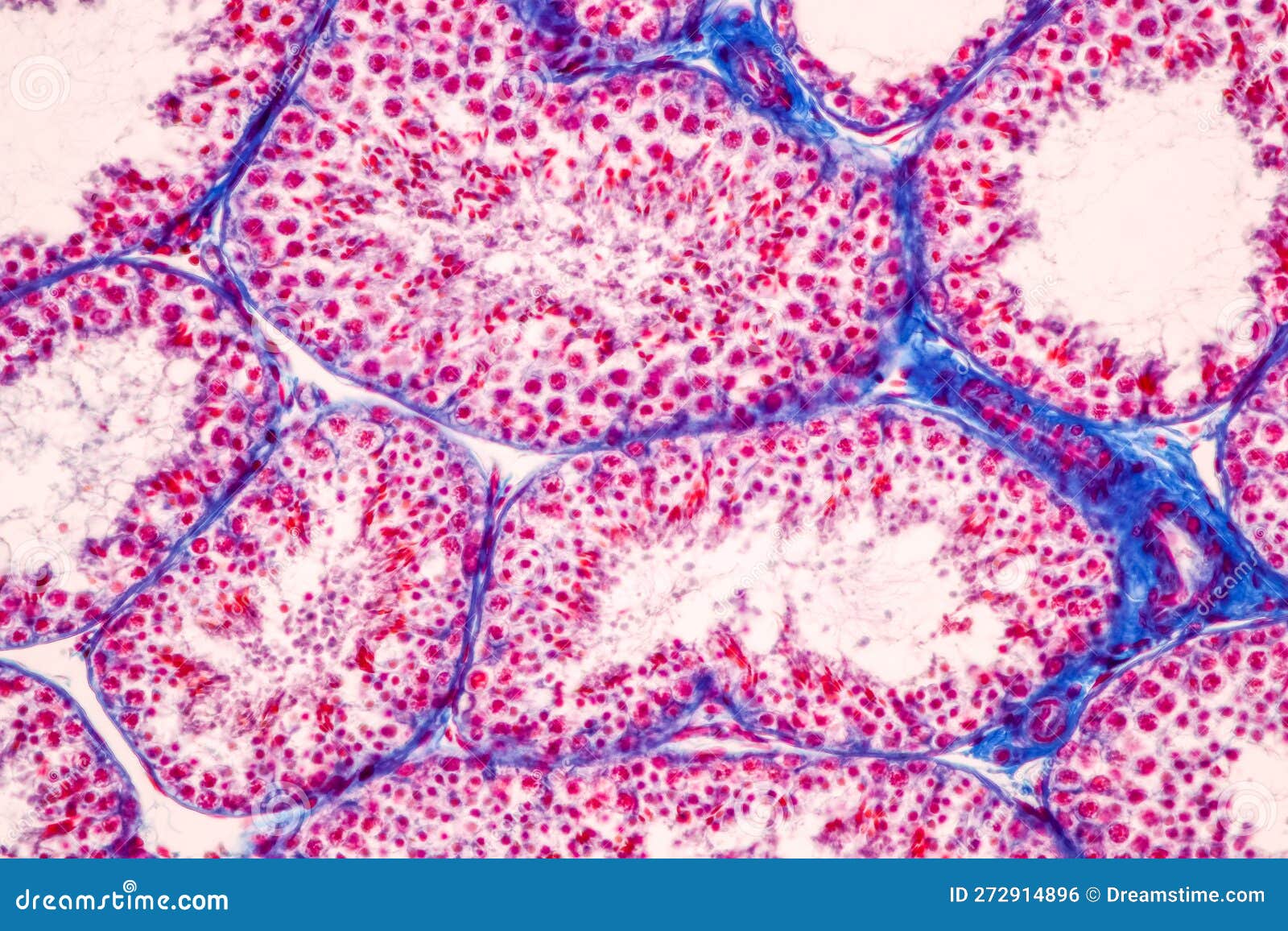 Histological Epididymis and Testis Human Cells Under Microscope. Stock ...