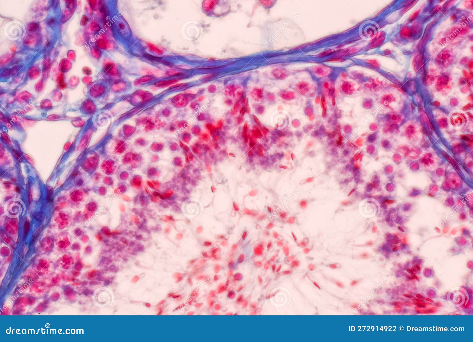 Histological Epididymis and Testis Human Cells Under Microscope. Stock ...
