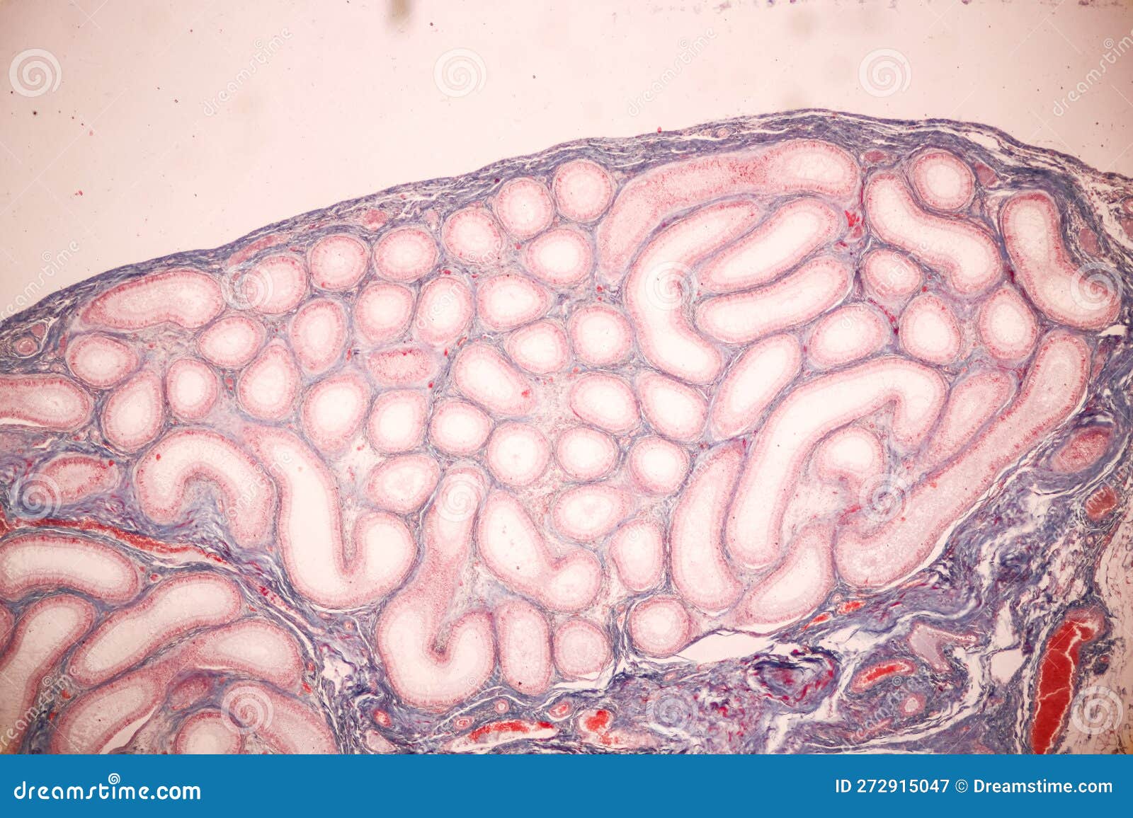 Histological Epididymis and Testis Human Cells Under Microscope. Stock ...