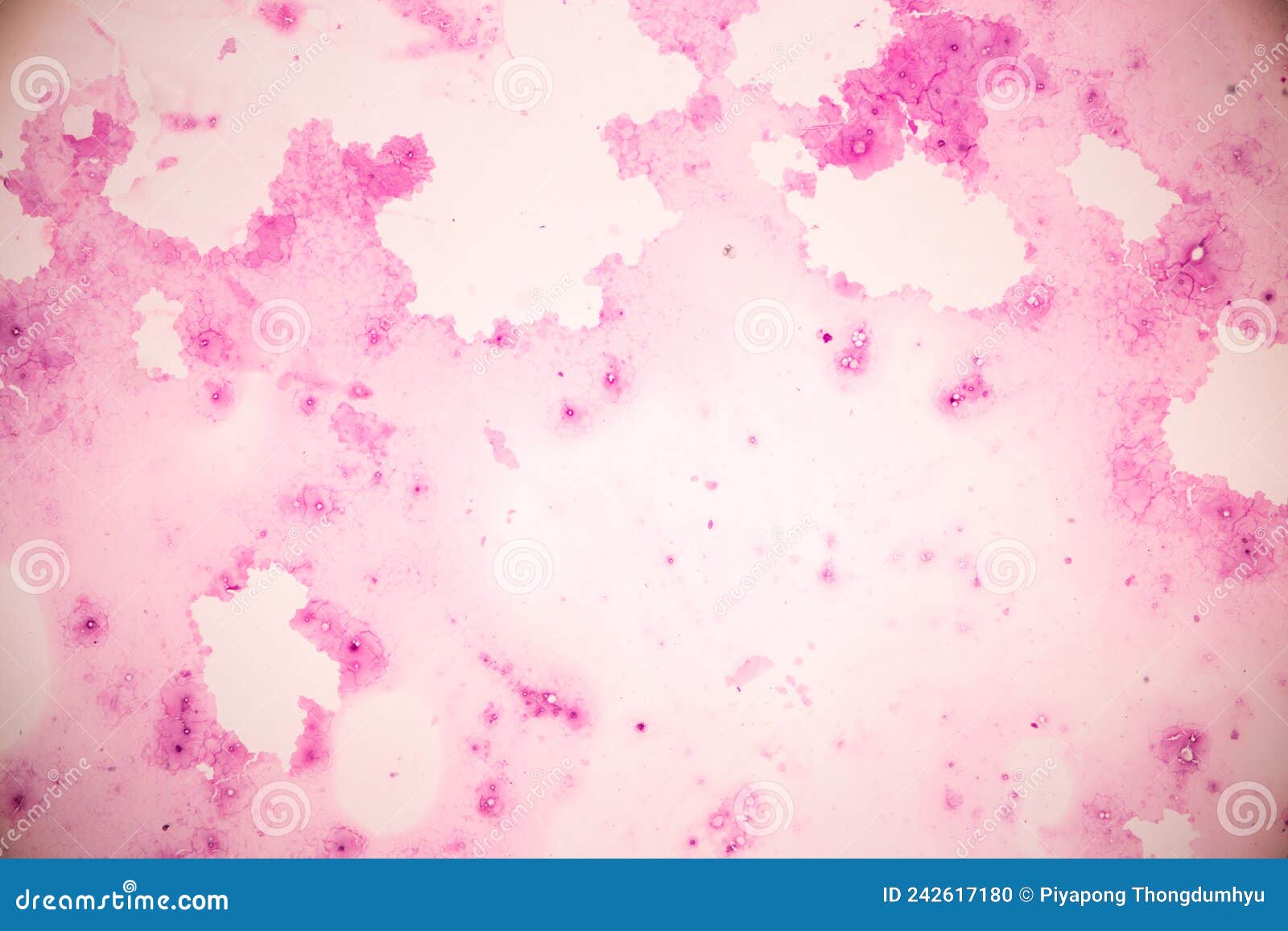 Histological Ovary, Testis and Sperm Human Cells Under Microscope ...