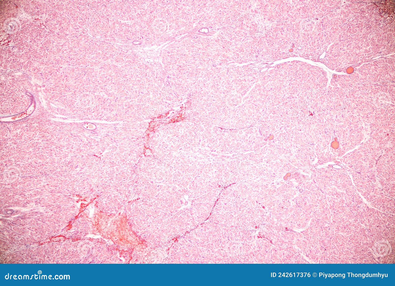 Histological Ovary, Testis and Sperm Human Cells Under Microscope ...