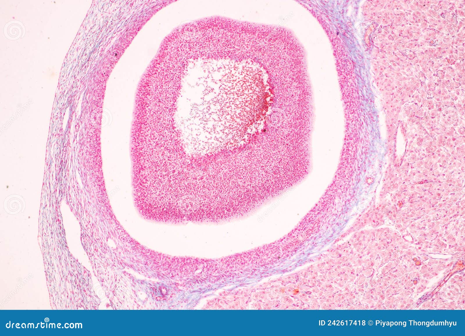 Histological Ovary, Testis and Sperm Human Cells Under Microscope ...