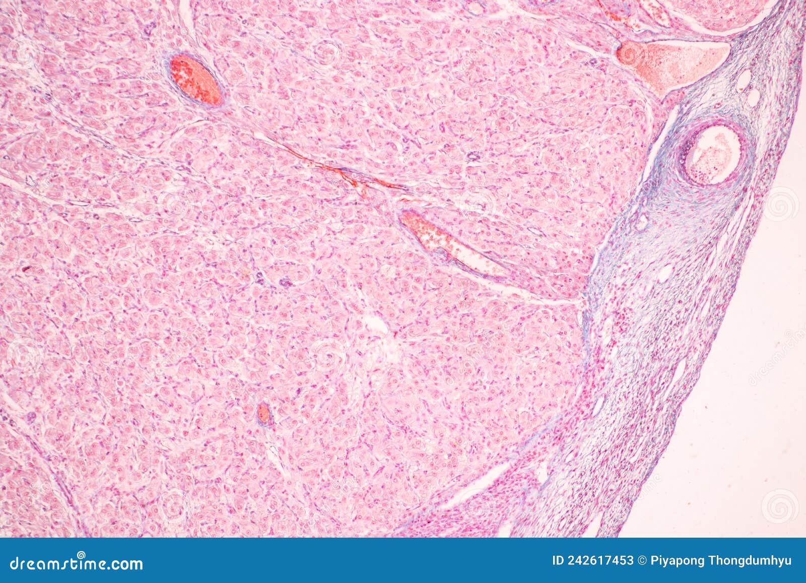 Histological Ovary, Testis and Sperm Human Cells Under Microscope ...