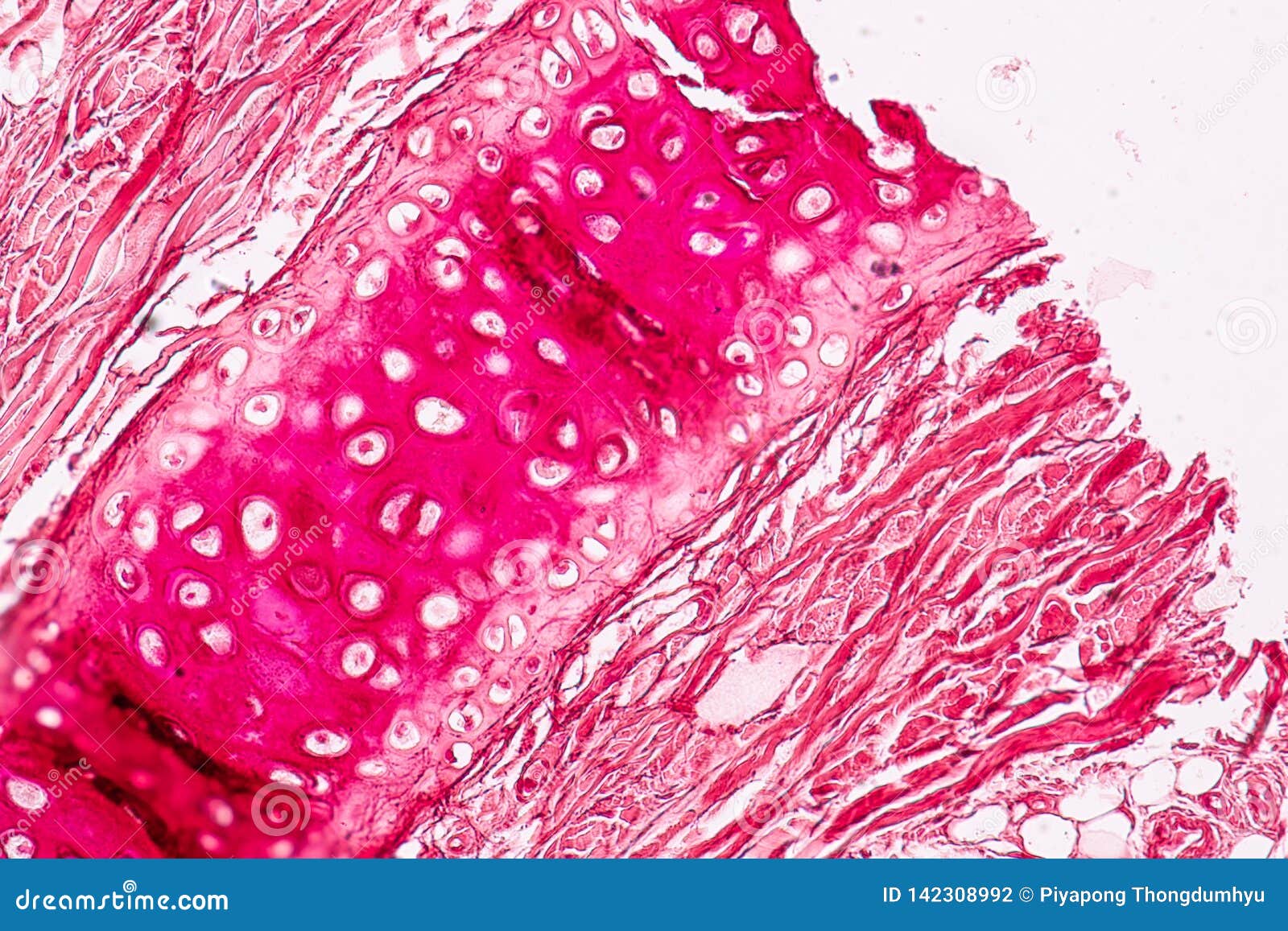 Histological Sample Elastic Cartilage Tisue Under The Microscope. Stock ... Histological Sample Elastic Cartilage Tisue Under The Microscope. Stock ...