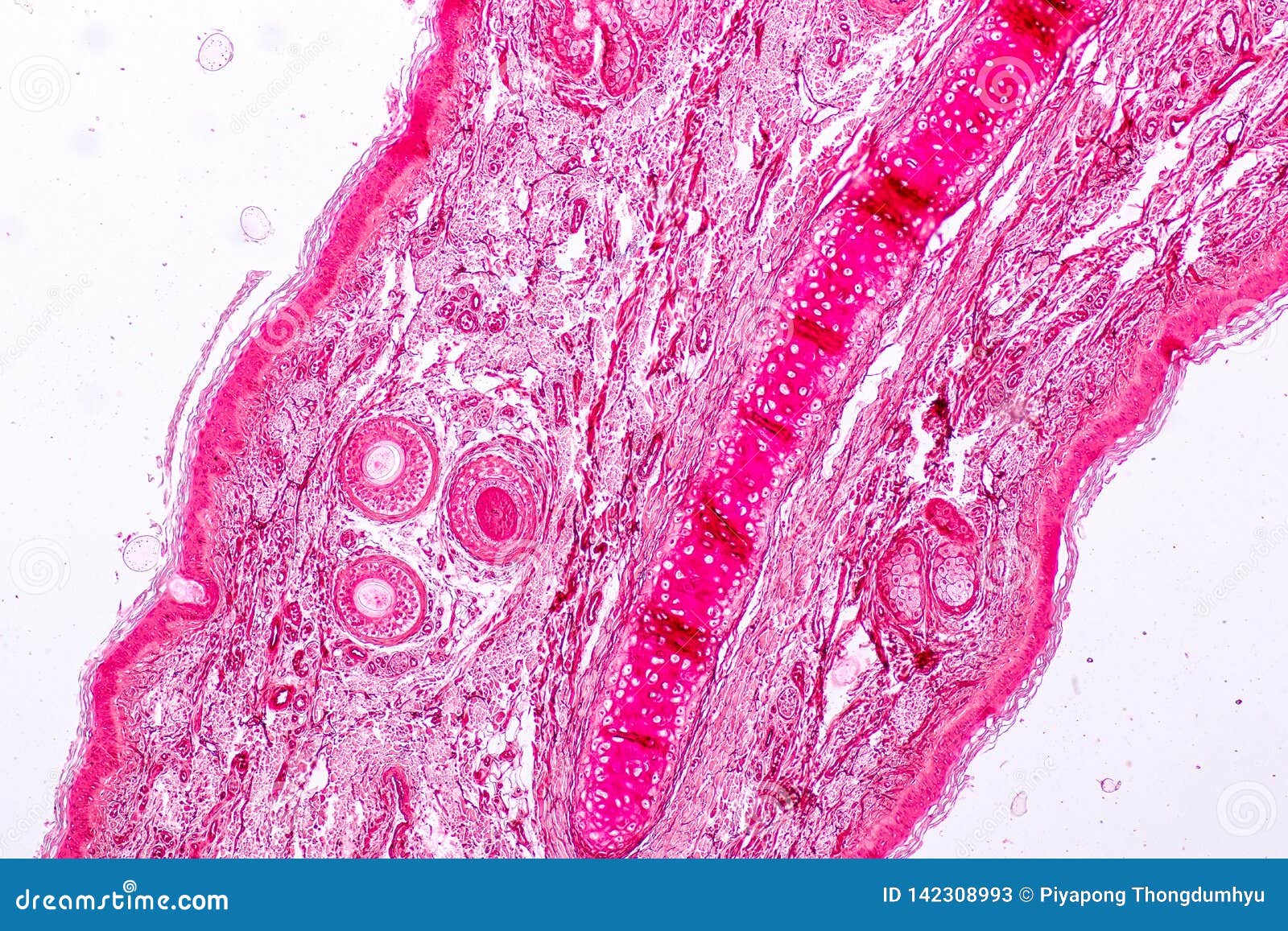 Elastic Cartilage Under Microscope Elastic Cartilage Under Microscope