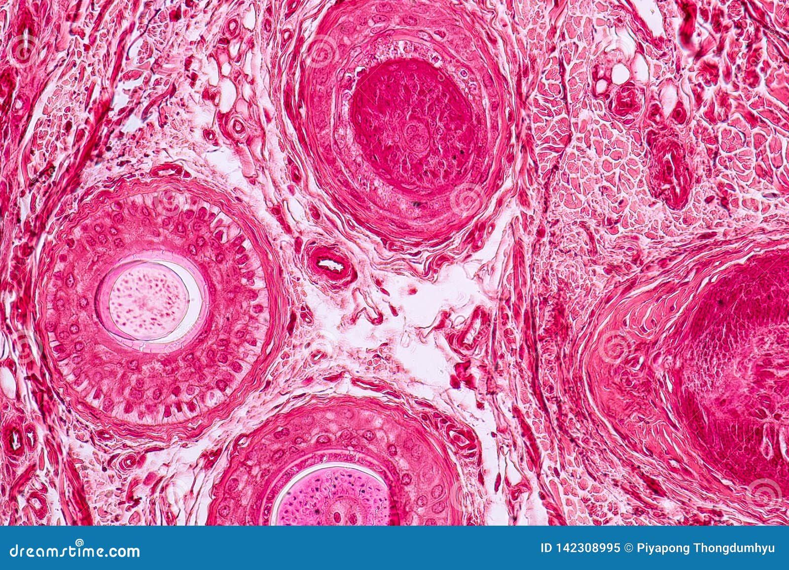 Histological Sample Elastic Cartilage Tisue Under the Microscope. Stock ... Histological Sample Elastic Cartilage Tisue Under the Microscope. Stock ...