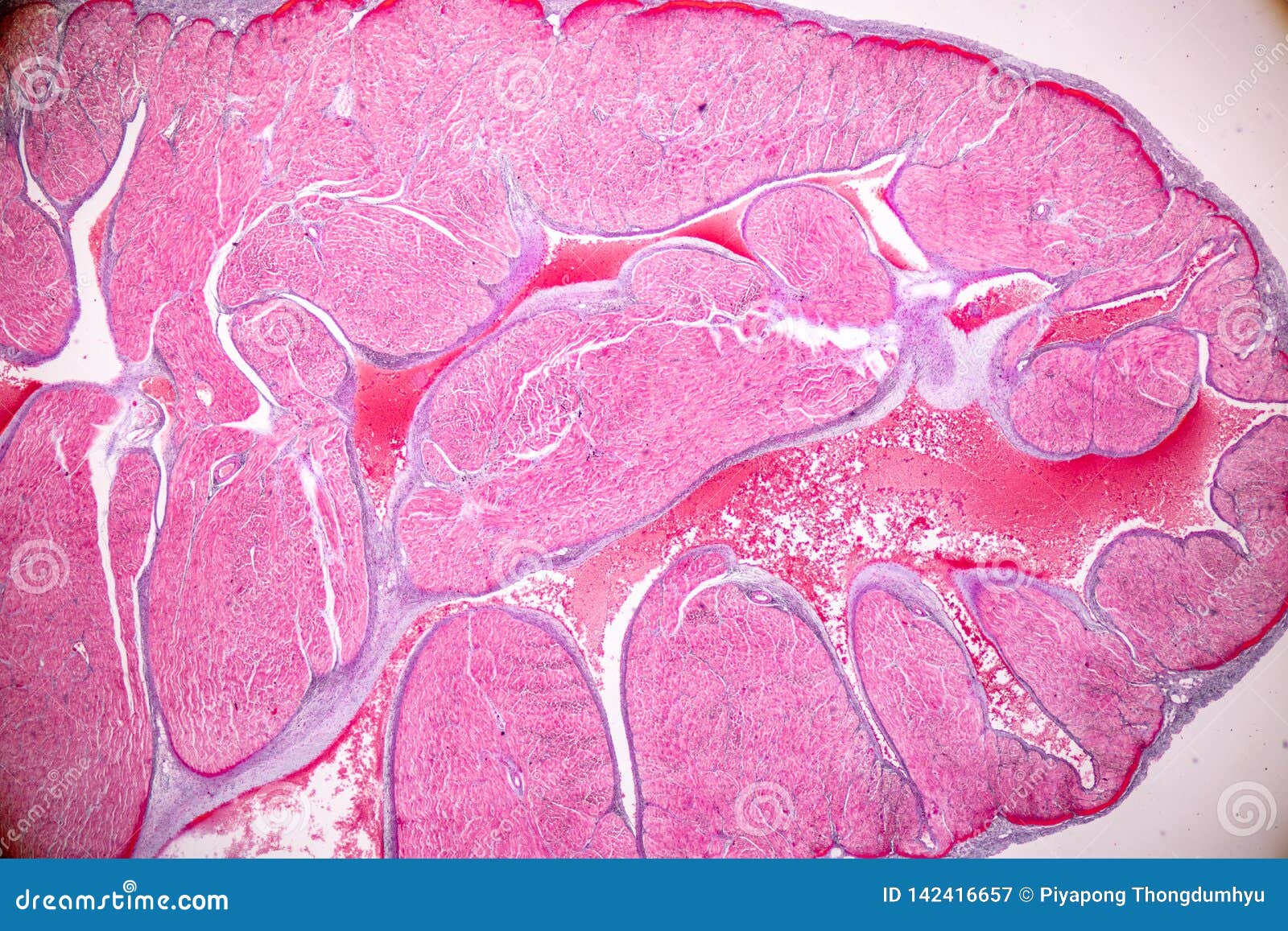 Histological Sample Heart Muscle Tissue Under the Microscope. Stock ...