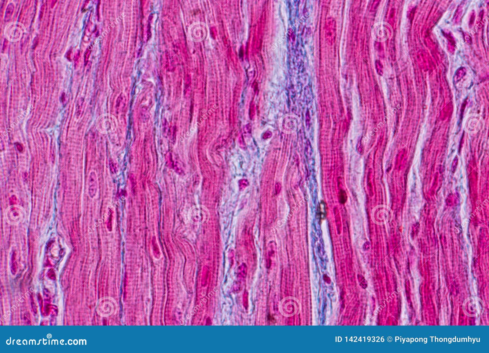 Histological Sample Simple Columnar Epithelium Tissue Under The ... Histological Sample Simple Columnar Epithelium Tissue Under The ...